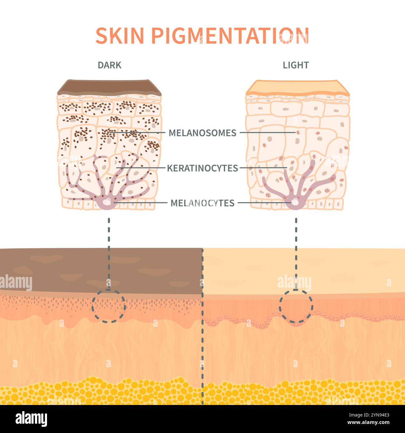 Melasma pigmentation Stock Vector Images - Alamy
