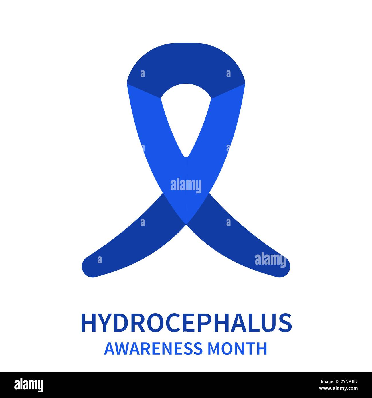 Hydrocephalus Stock Vector Images - Alamy