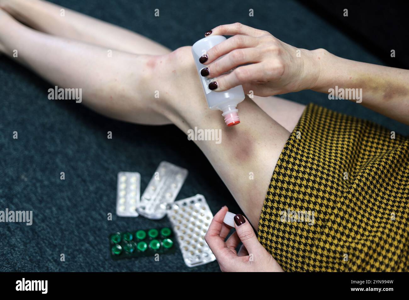 Young woman applying medication to her bruises sitting on the floor ...