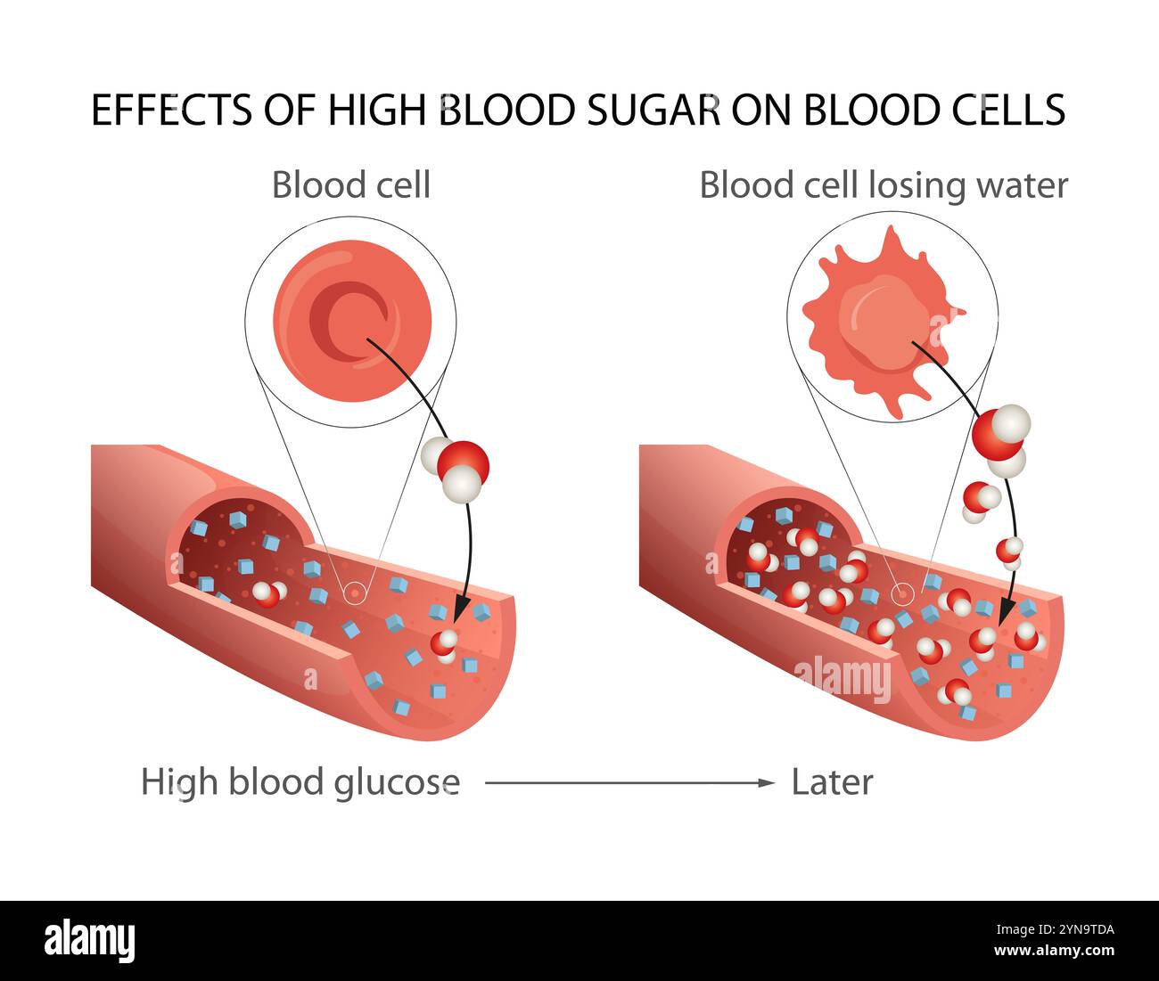 Low red blood cells hi-res stock photography and images - Alamy