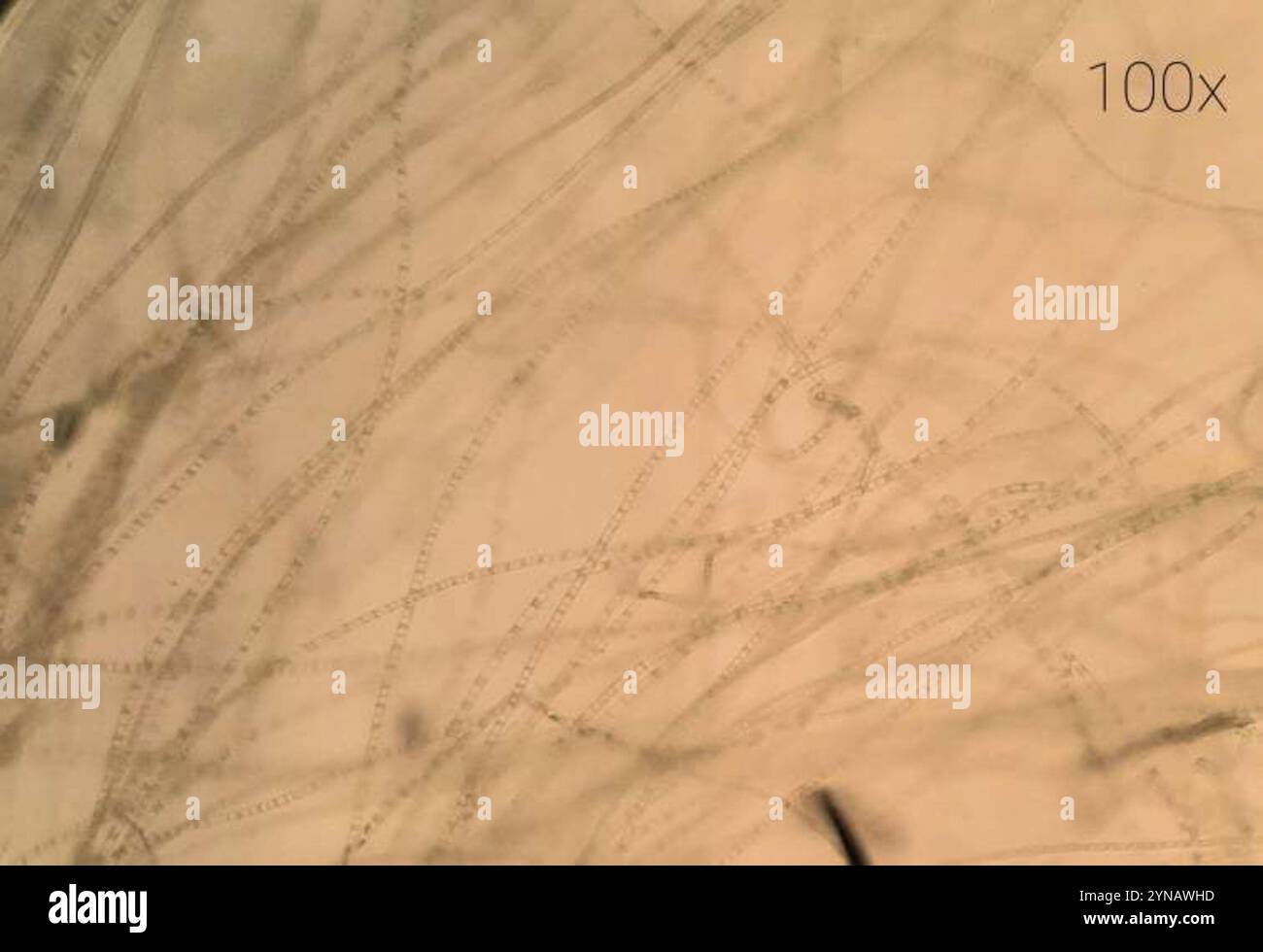 Ulothrix hi-res stock photography and images - Alamy