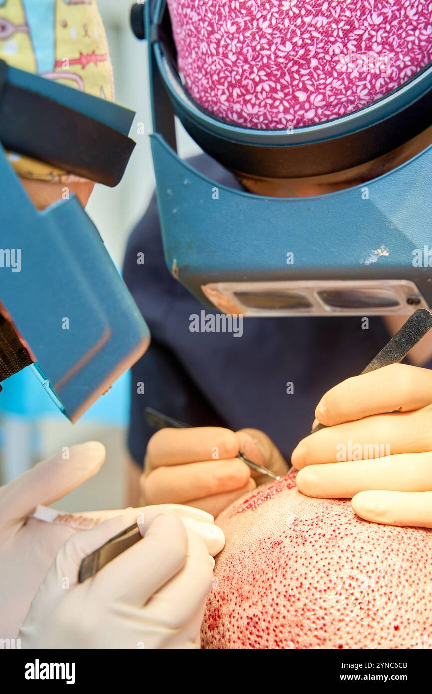 Advanced procedure hi-res stock photography and images - Alamy