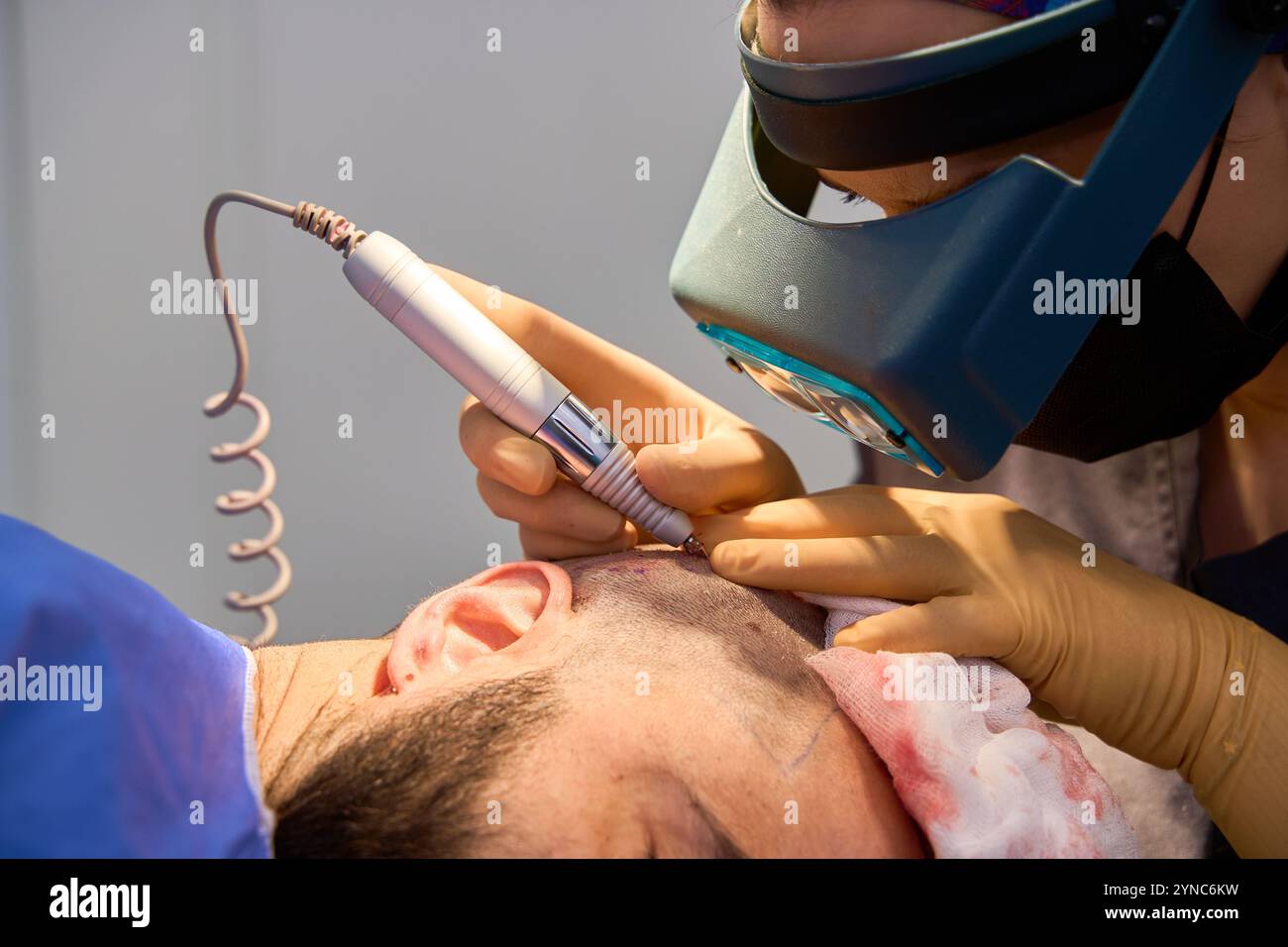 Surgeon using specialized tool for hair transplant procedure on ...
