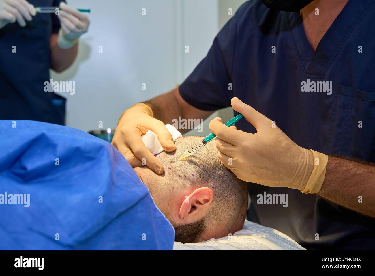 Doctor performing hair transplant procedure with syringe injection on ...