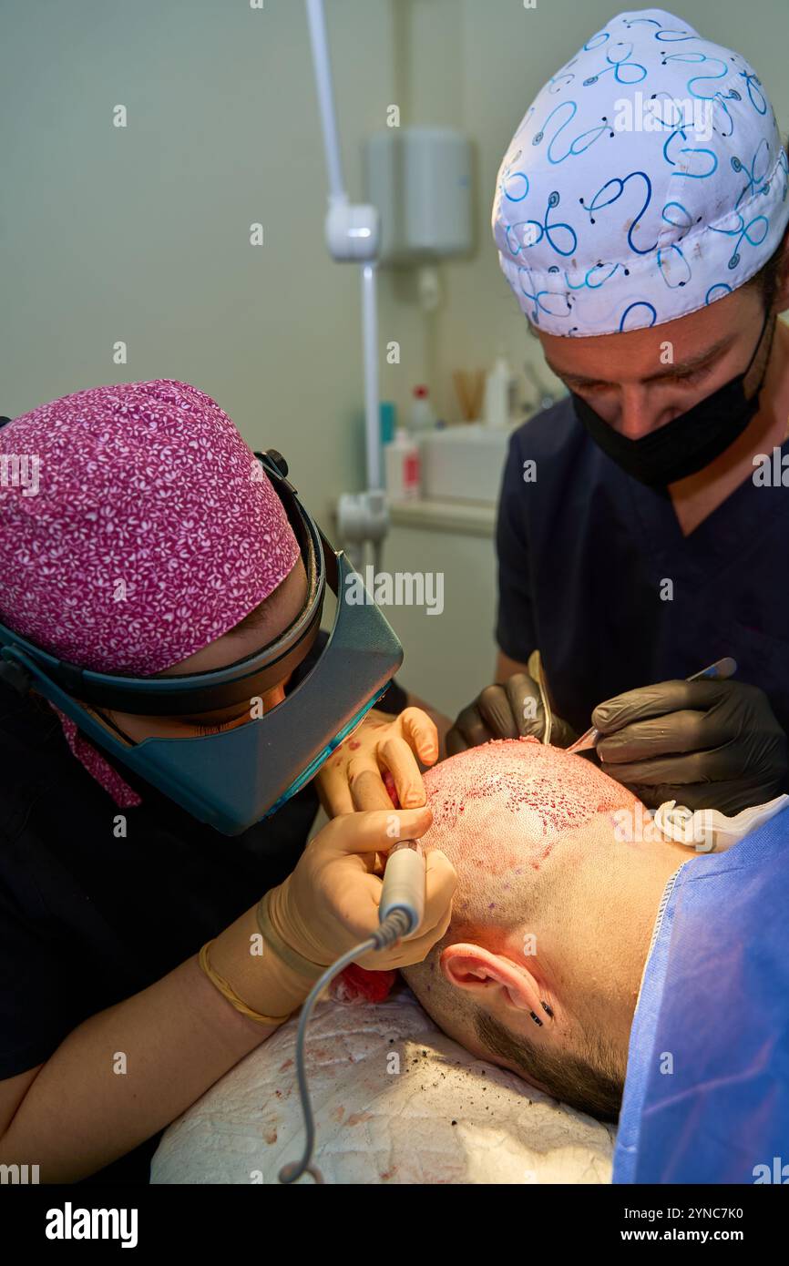 Two surgeons performing a hair transplant procedure using precision ...