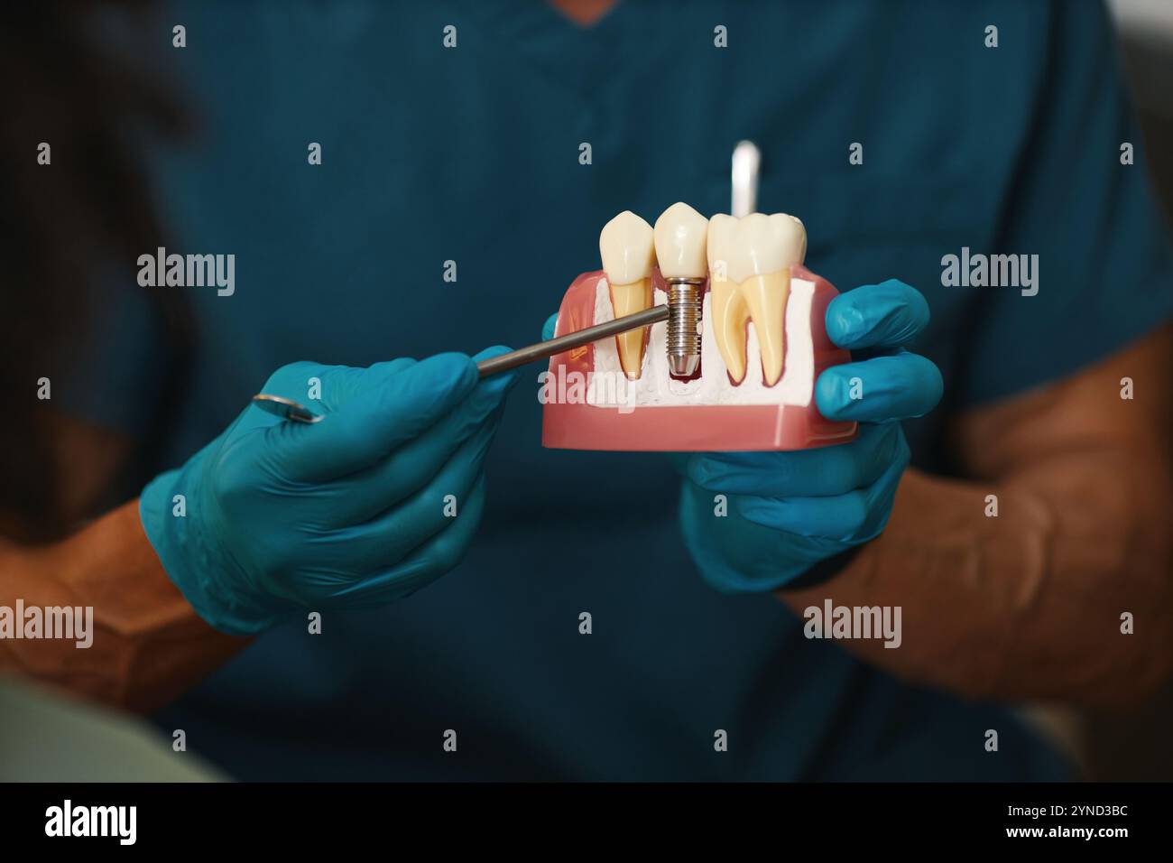 Dental anatomy model illustrating hi-res stock photography and images ...
