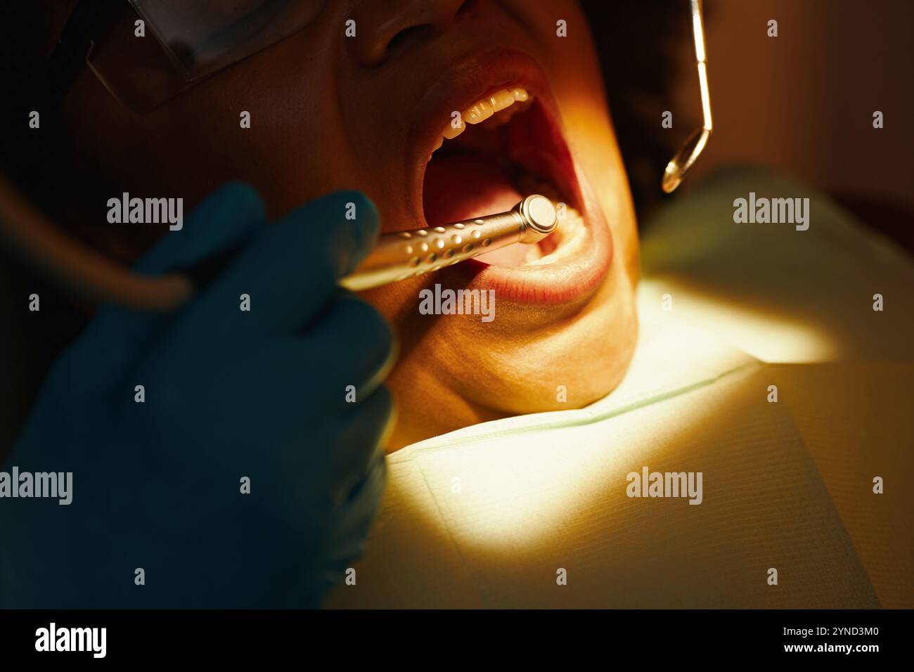 Dentist performing oral checkup hi-res stock photography and images - Alamy