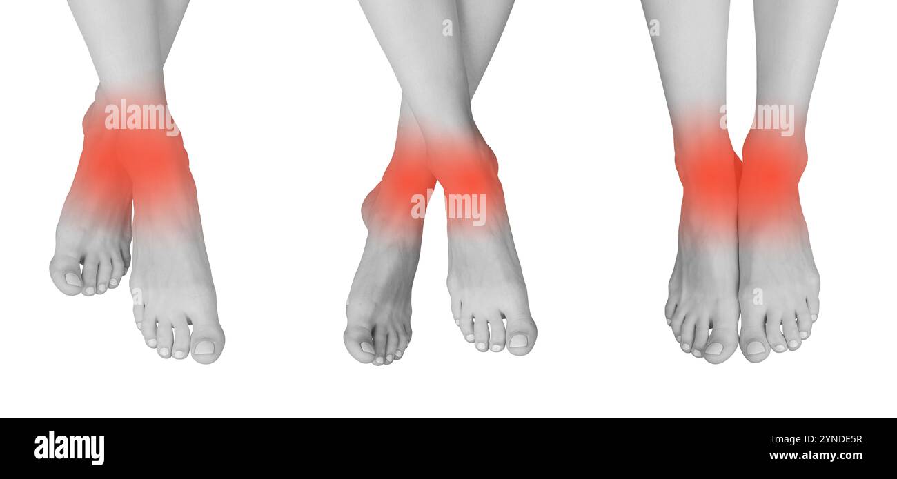 Set of female feet showing symptoms of pain and injury, including ...