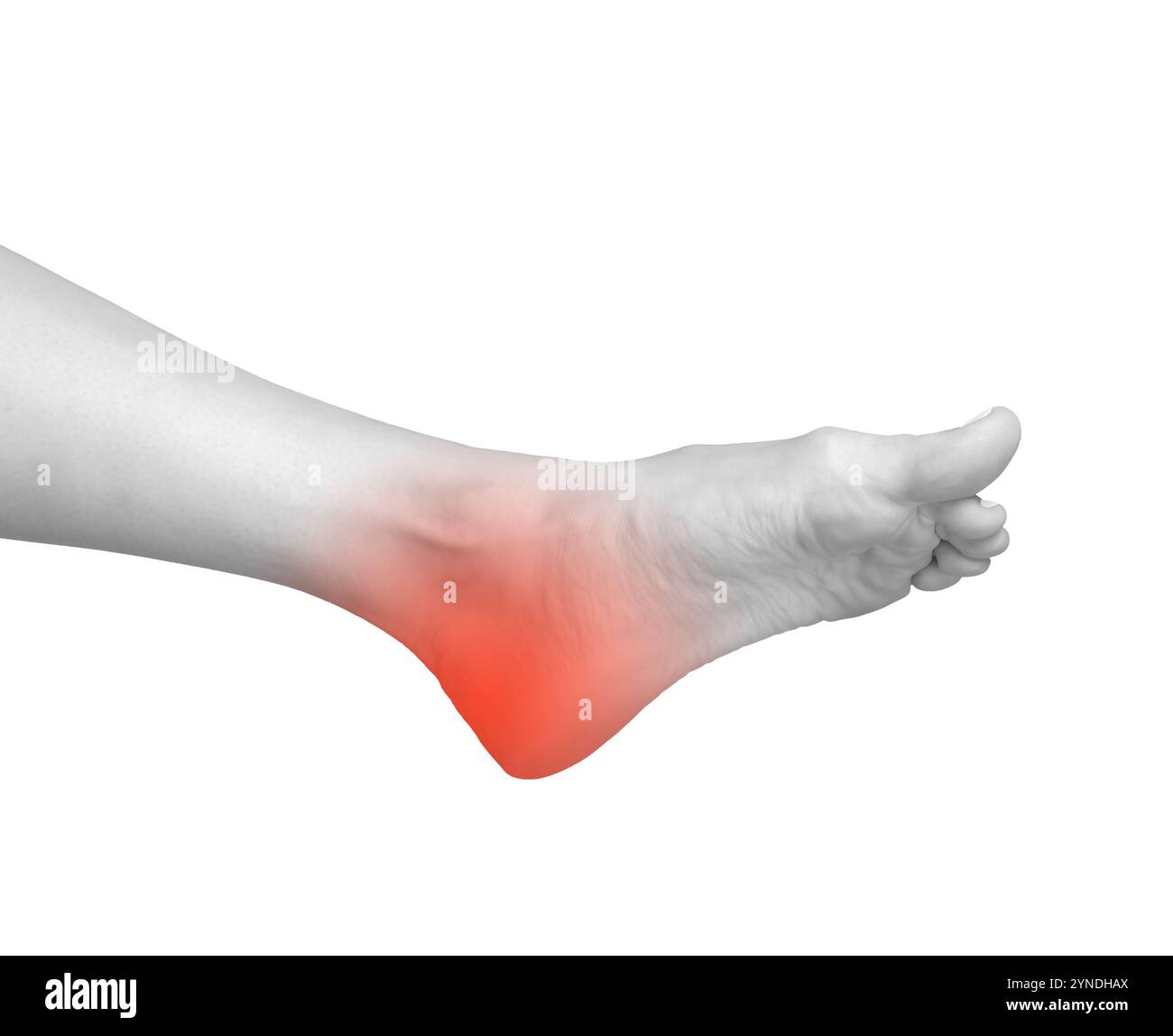 Foot pain, heel ache, joint problem, and neuropathy symptoms. Red ...