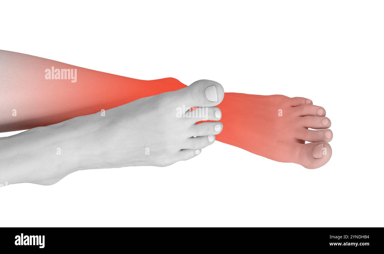 Foot pain, aching joint and inflamed bone. Female with sore feet ...