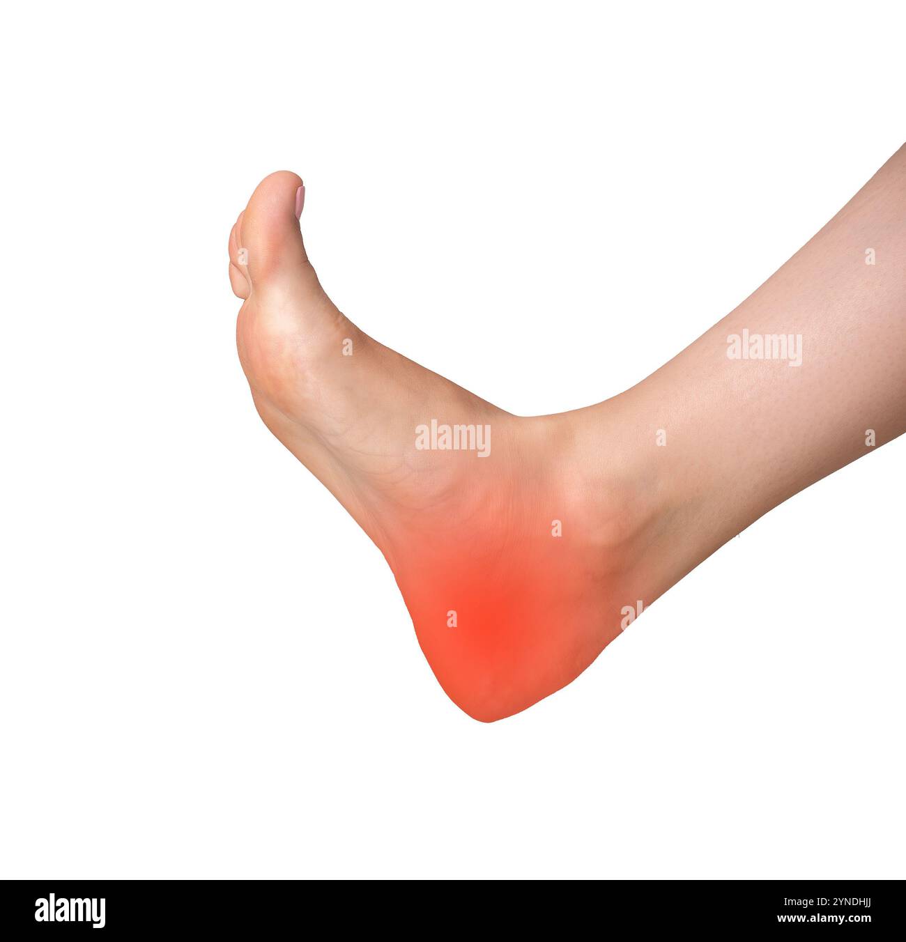 Heel injury hi-res stock photography and images - Alamy