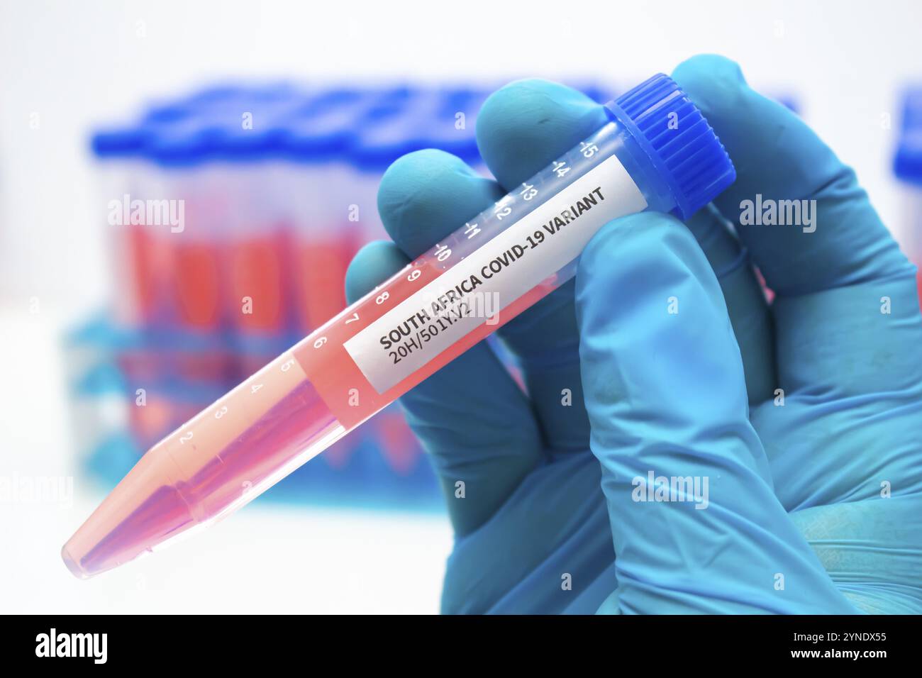A medical Worker holding a centrifuge tubes with graduated marks with a ...