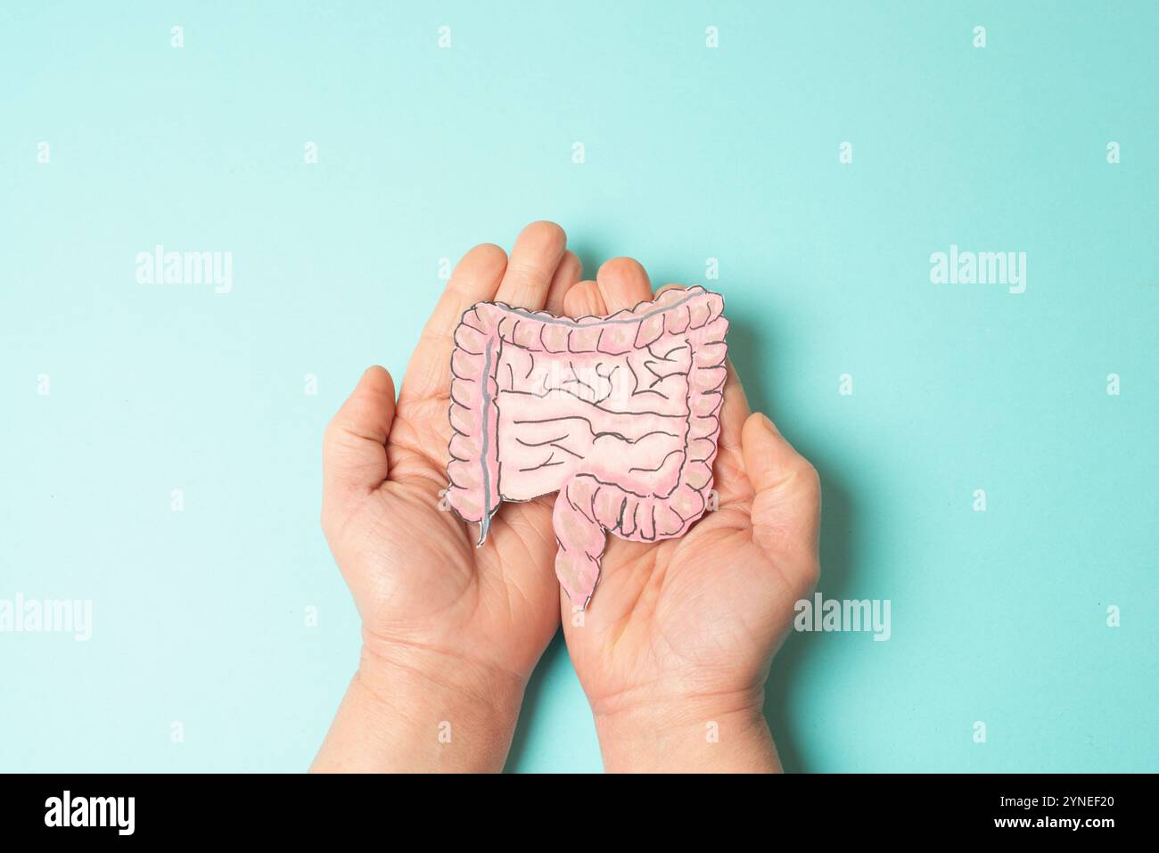 Colon, colorectal or rectal cancer, inflammatory bowel disease, weight ...