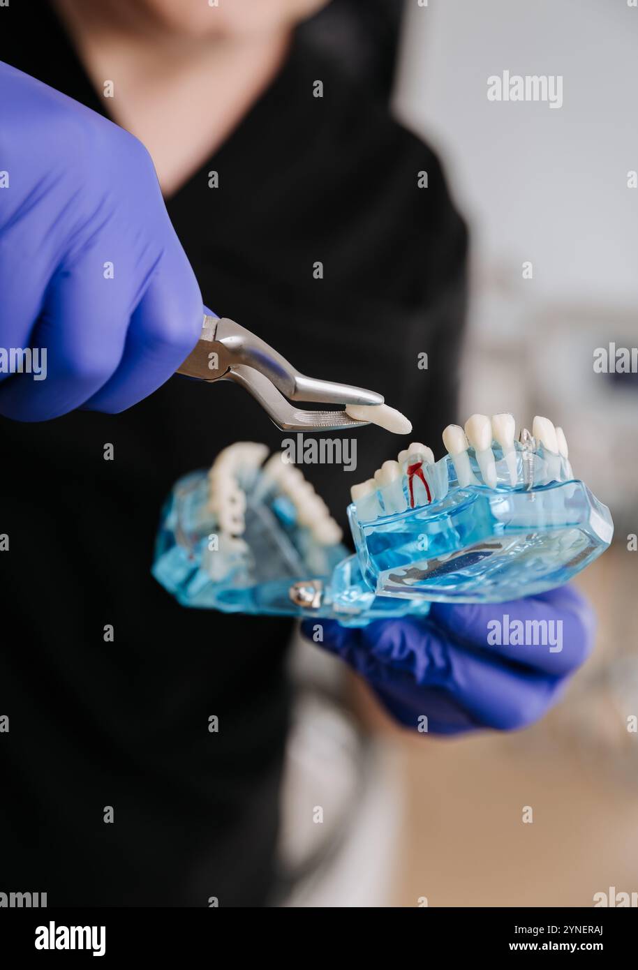 Dentist demonstrating tooth extraction using a transparent jaw model in ...