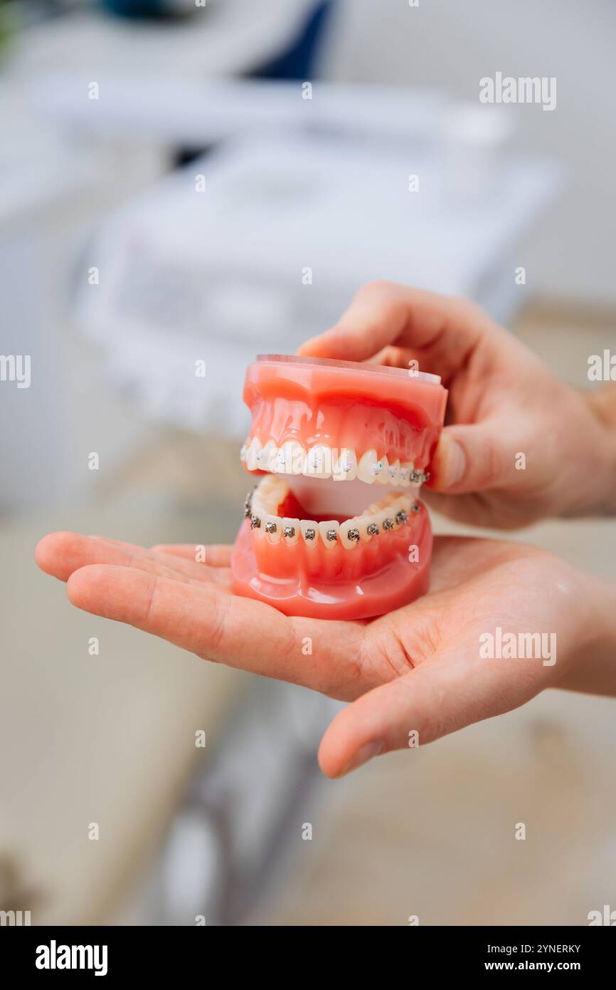 Orthodonticdisplay hi-res stock photography and images - Alamy