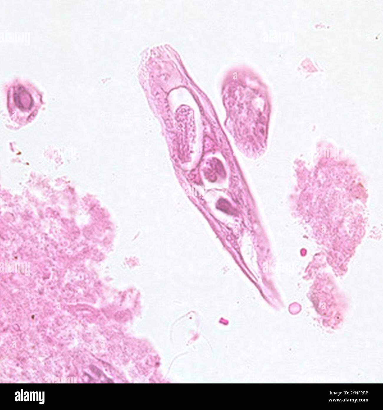 Capillaria hi-res stock photography and images - Alamy