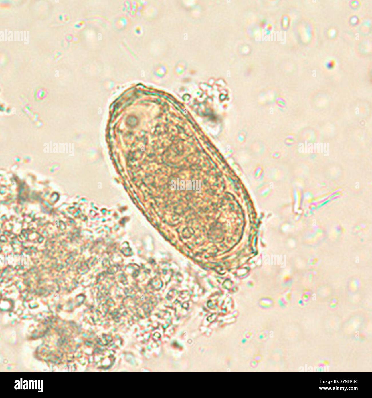 Capillaria philippinensis egg (02 Stock Photo - Alamy