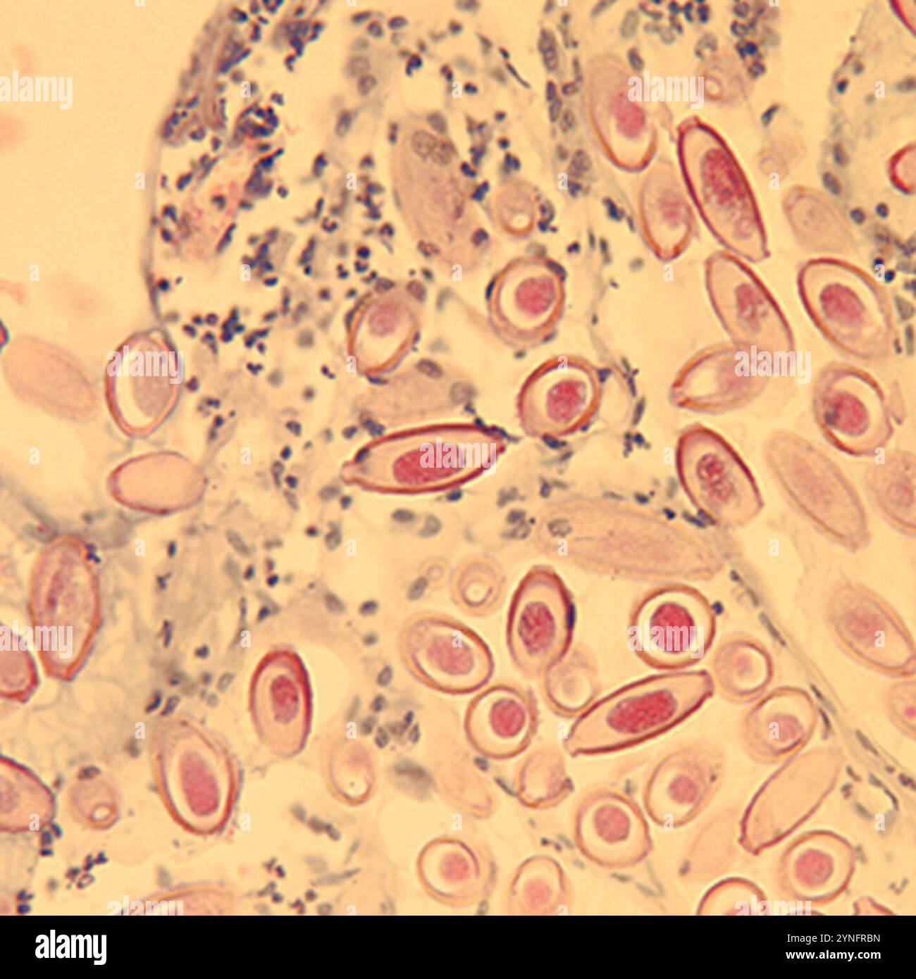 Capillaria hepatica eggs HE Stock Photo - Alamy