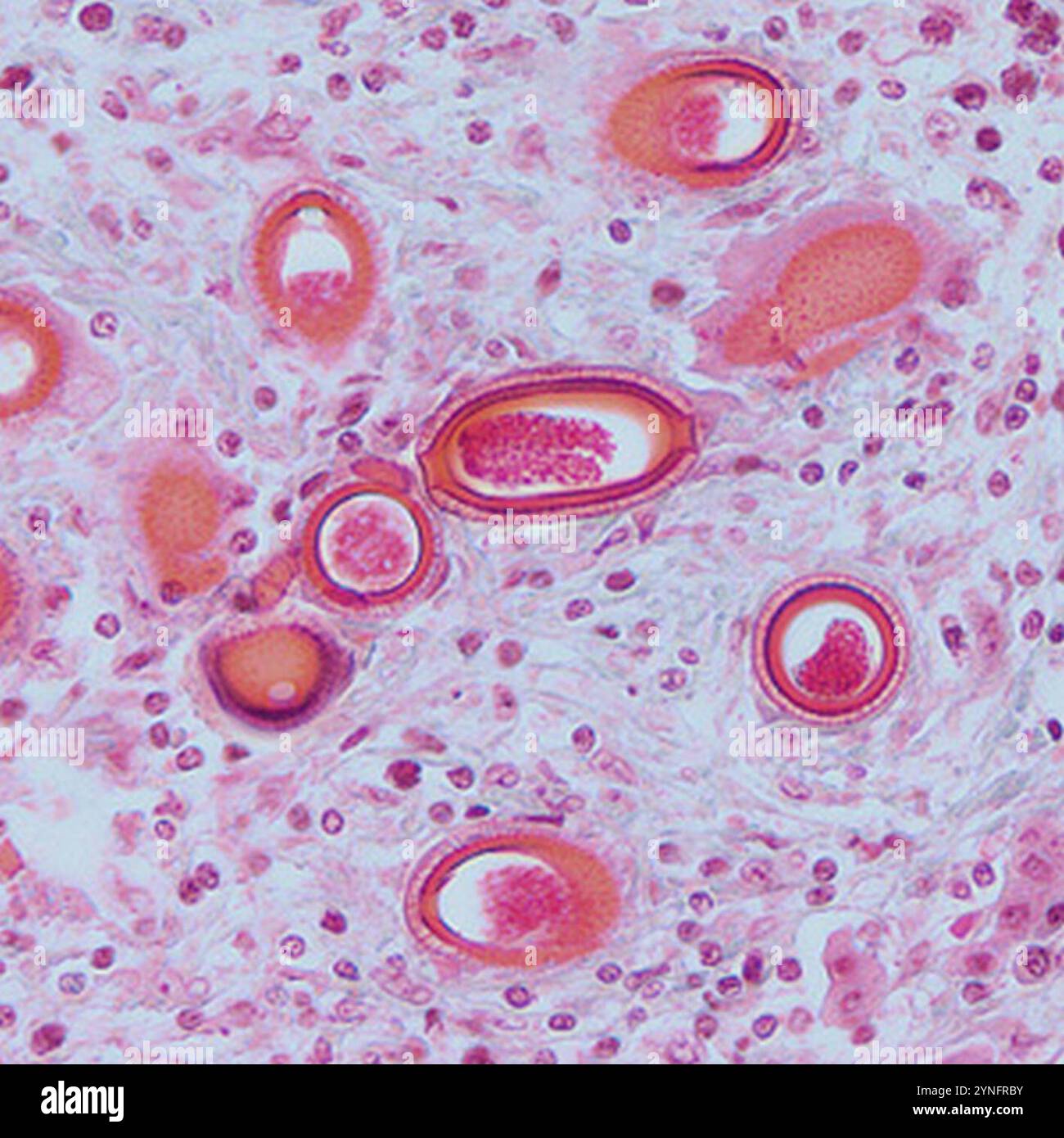 Capillaria hepatica tissue HB Stock Photo - Alamy
