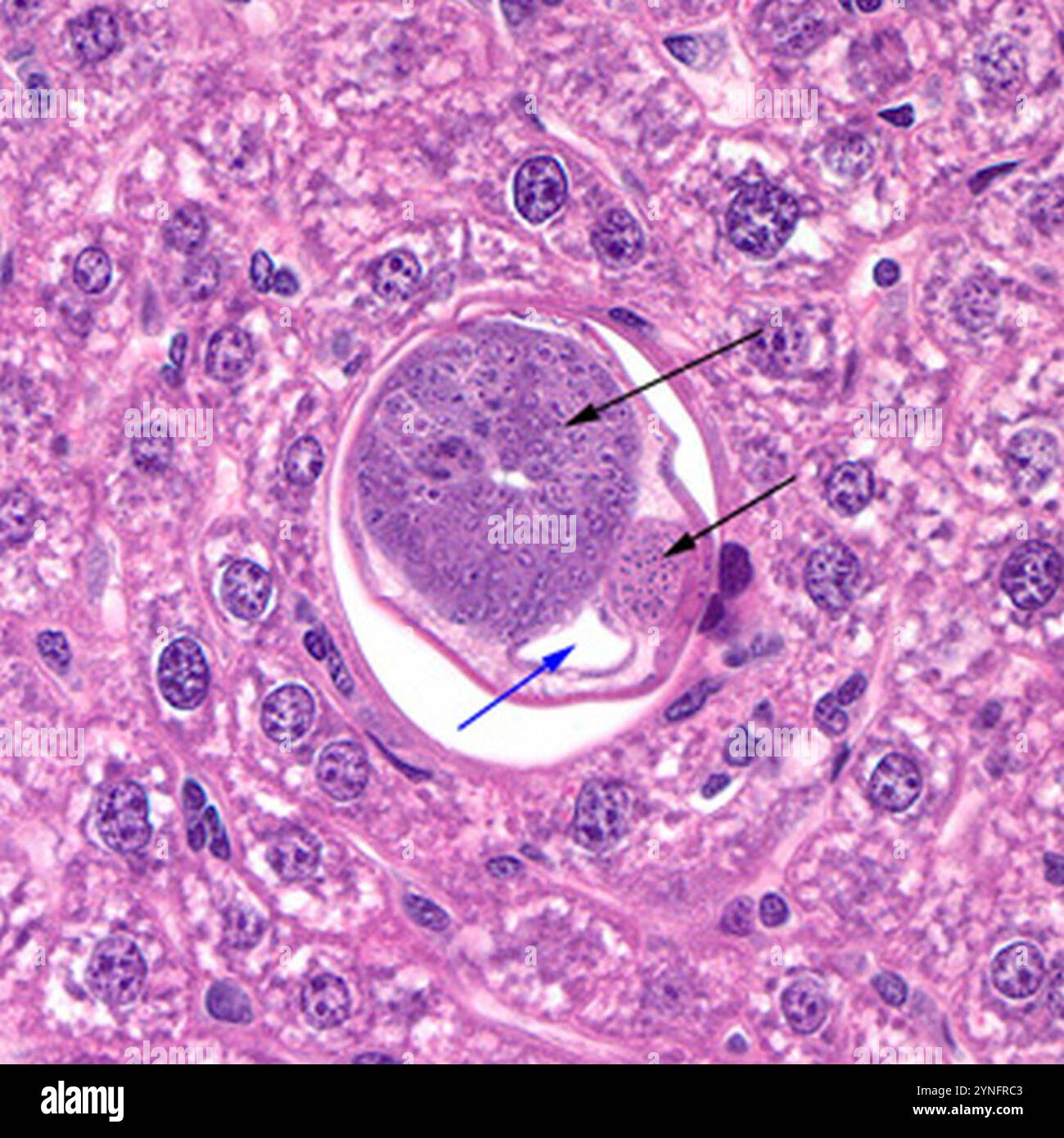 Capillaria hepatica 400x male liver Stock Photo - Alamy