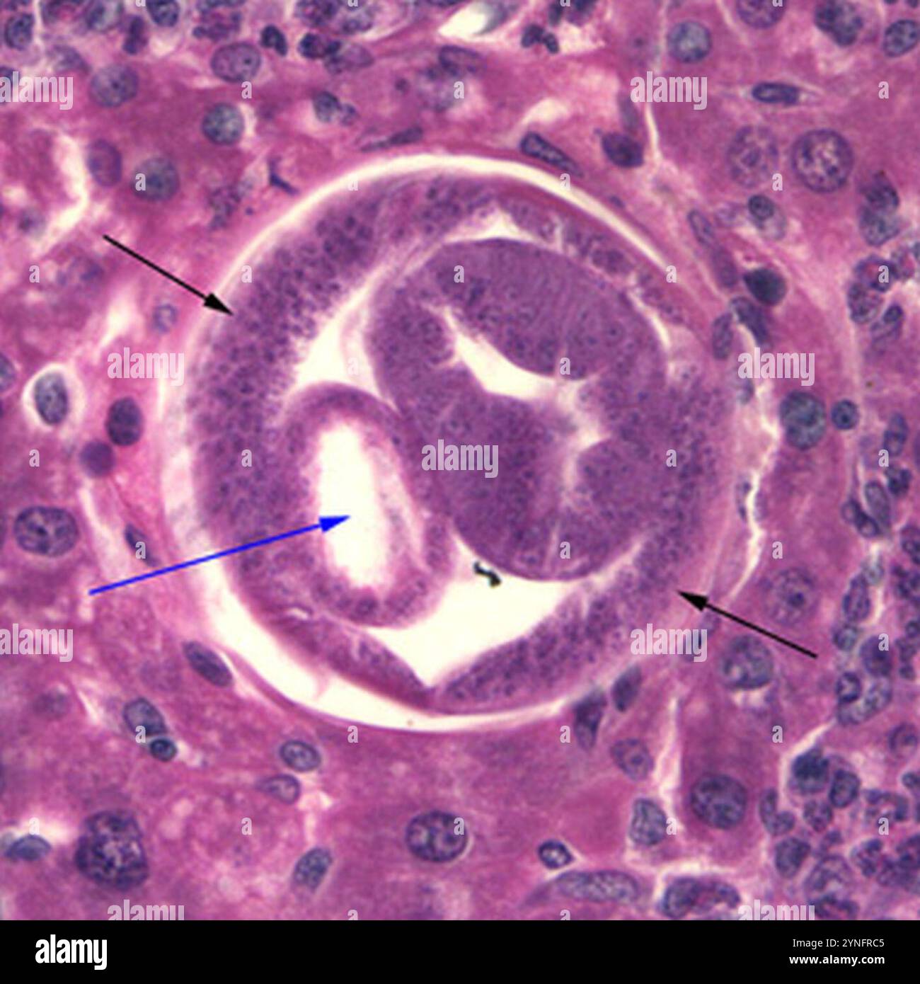 Capillaria hi-res stock photography and images - Alamy