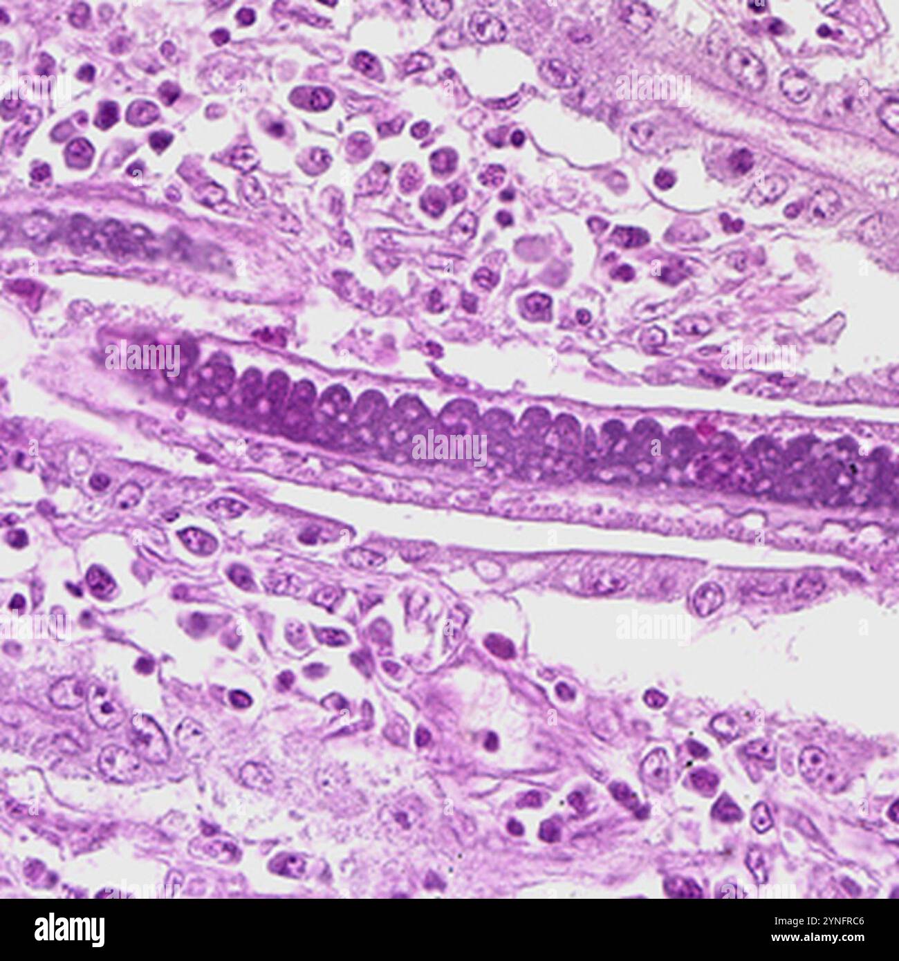 Capillaria hi-res stock photography and images - Alamy