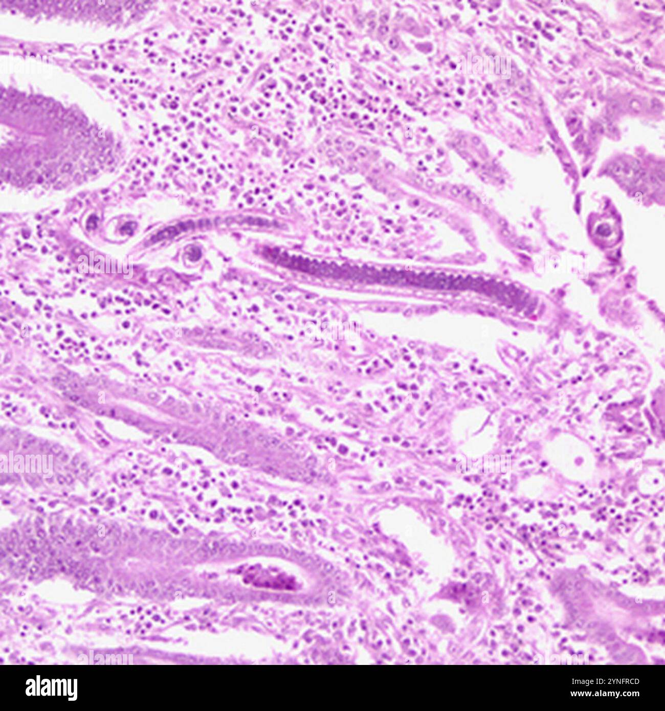 Capillaria philippinensis HE1 Stock Photo - Alamy