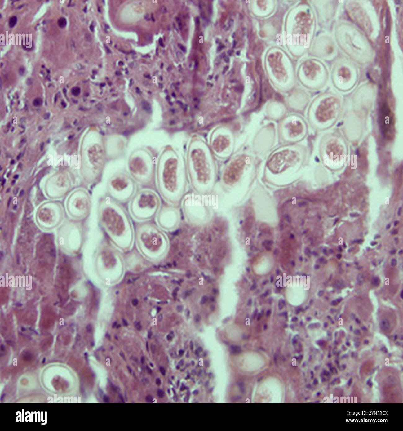 Capillaria hepatica eggs 200x HB Stock Photo - Alamy