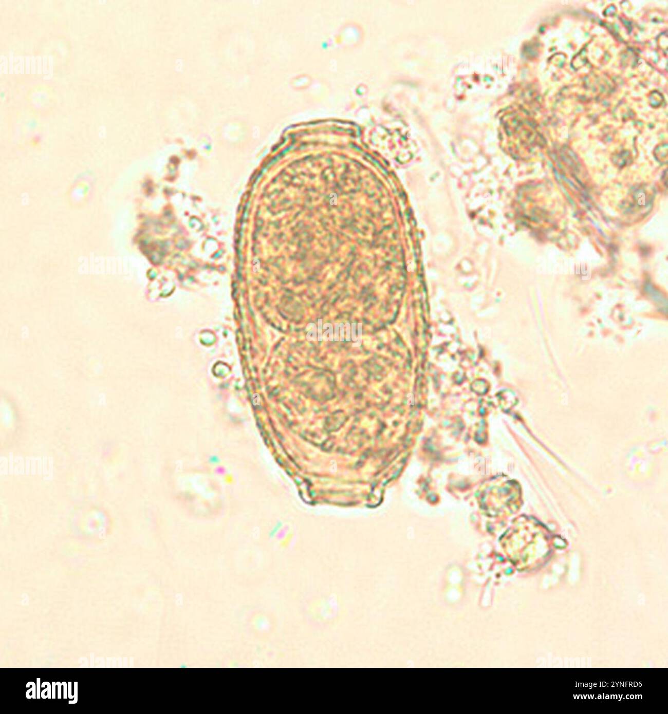 Capillaria philippinensis egg (03 Stock Photo - Alamy