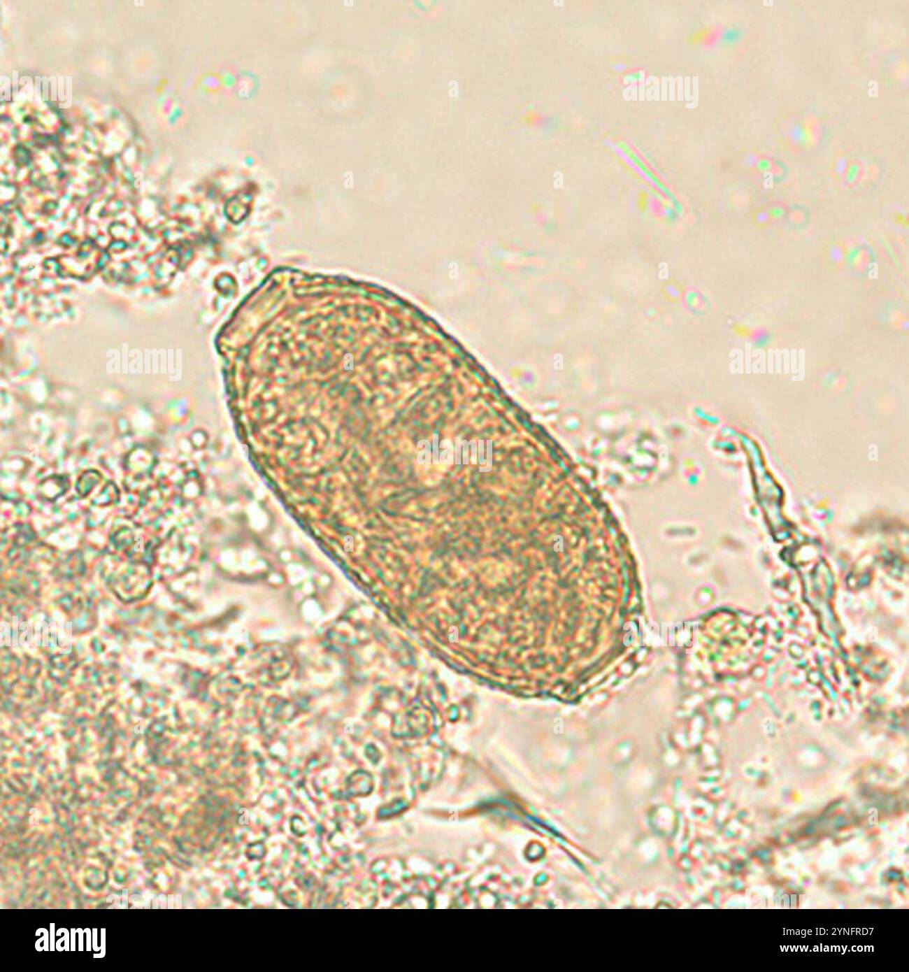 Capillaria philippinensis egg (01 Stock Photo - Alamy