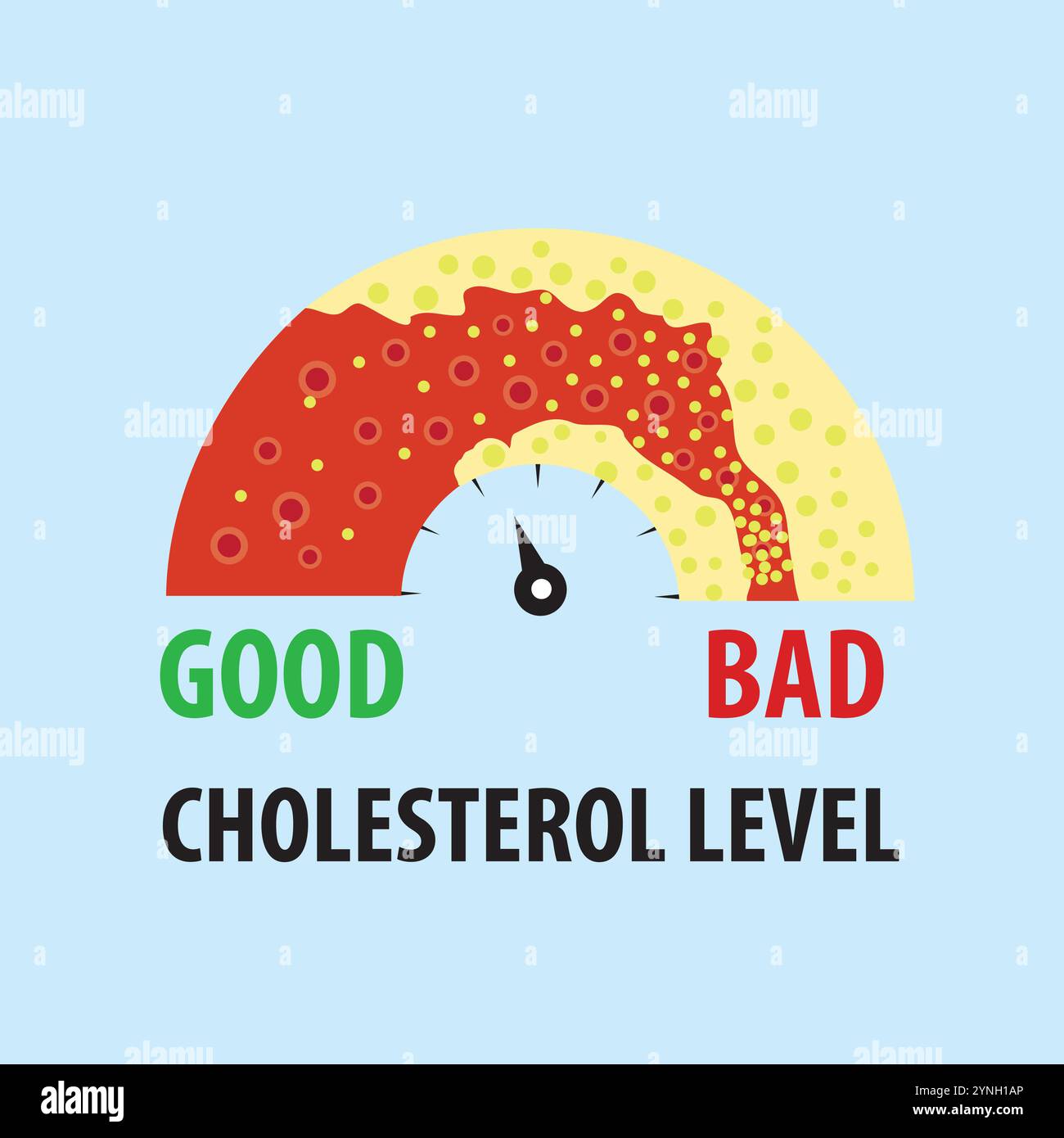 Cholesterol level on blocked blood vessel medical diagram. Meter gauge ...