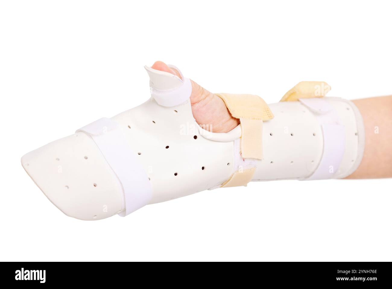 Hand splint hi-res stock photography and images - Alamy