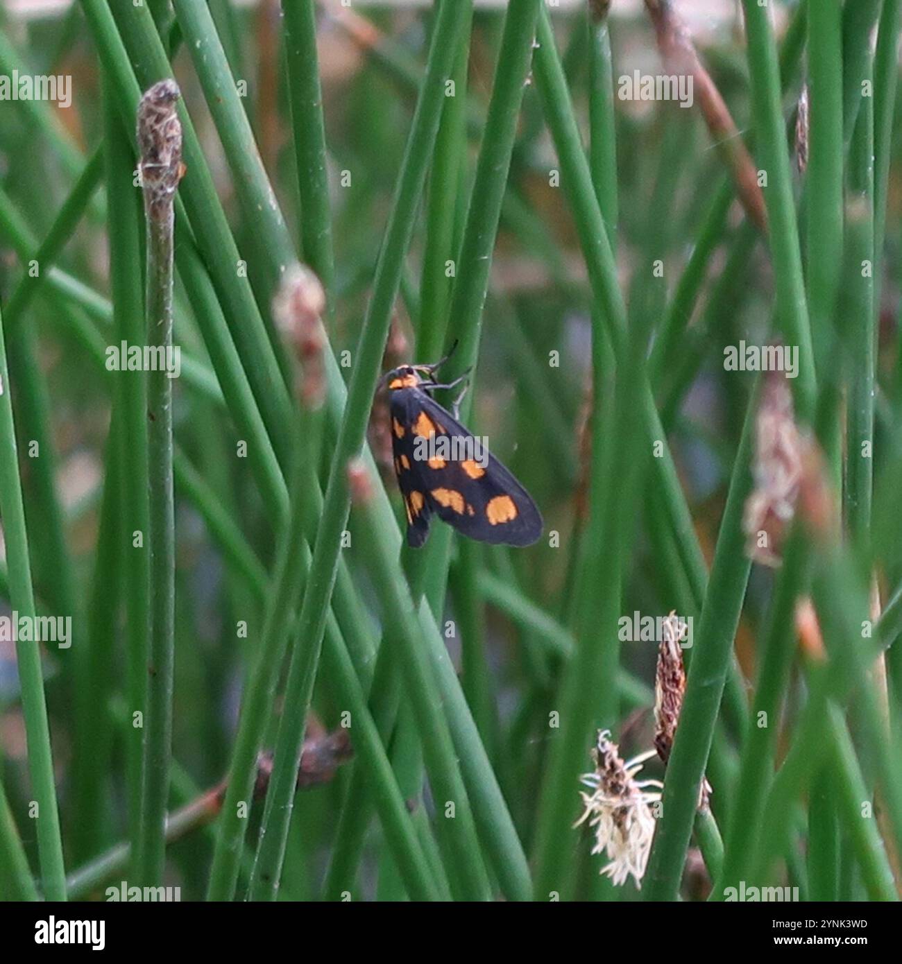 Cervicalis hi-res stock photography and images - Alamy