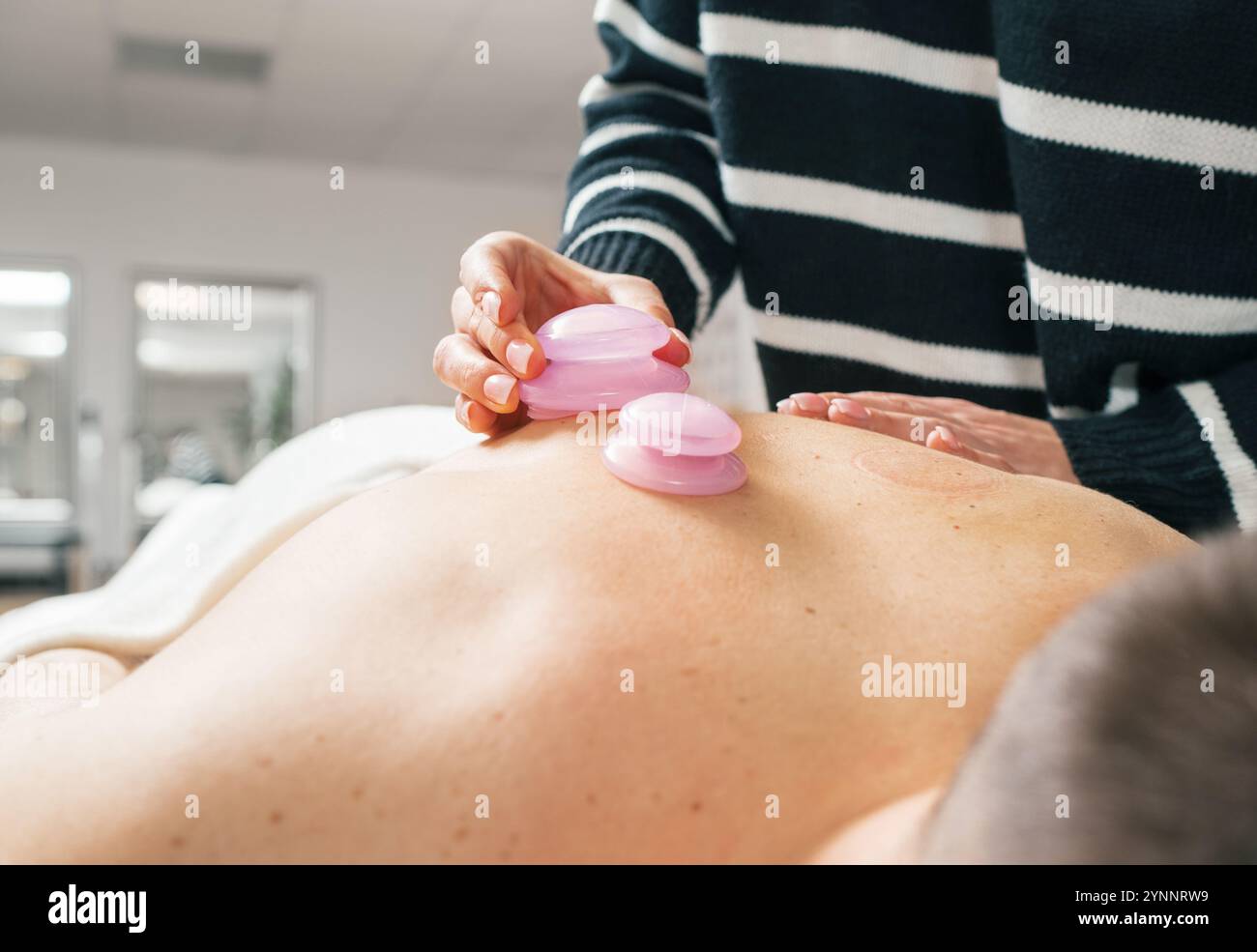 Therapist's hands performing vacuum cupping therapy treatment on female ...