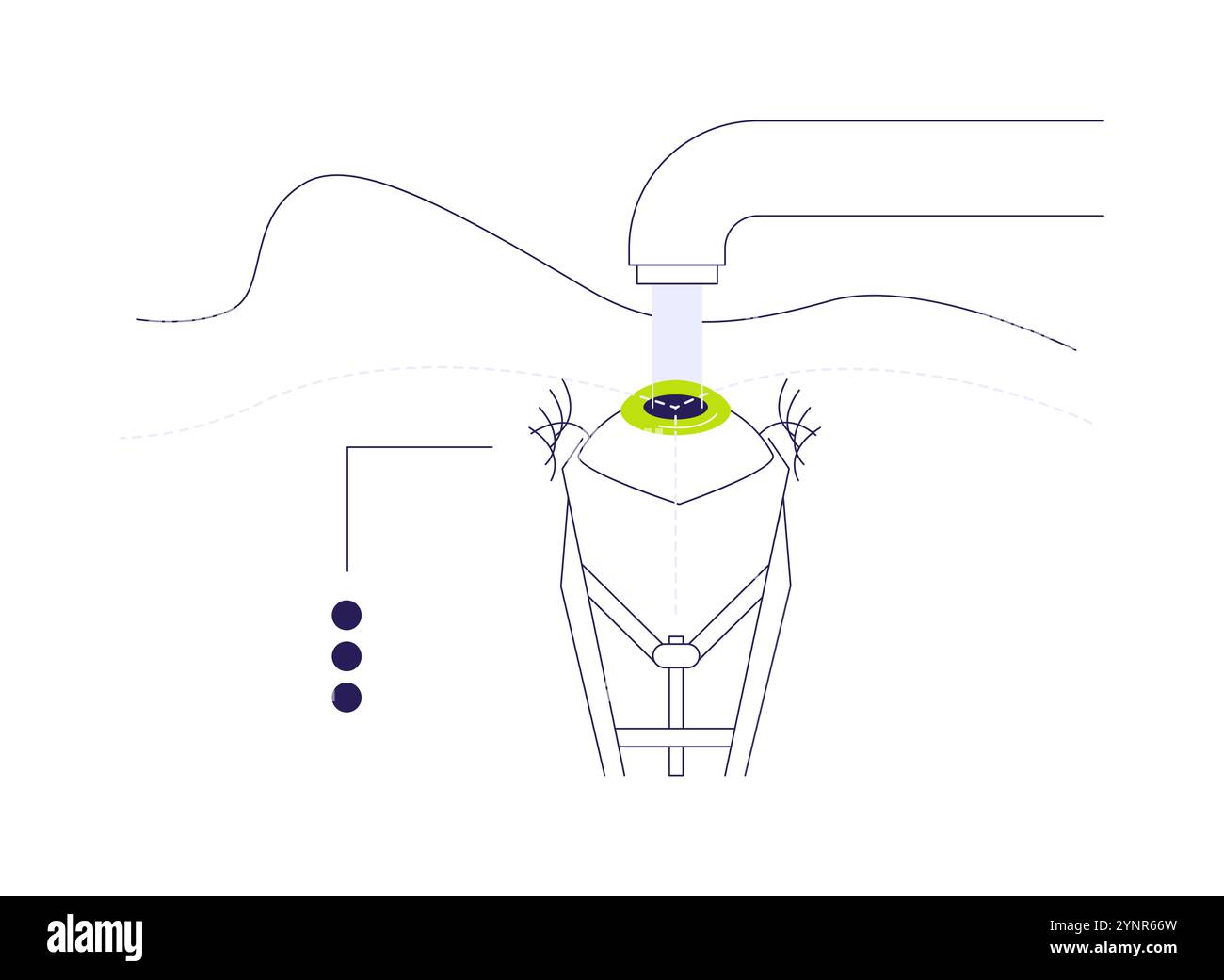 Cataract surgery procedure abstract concept vector illustration Stock ...