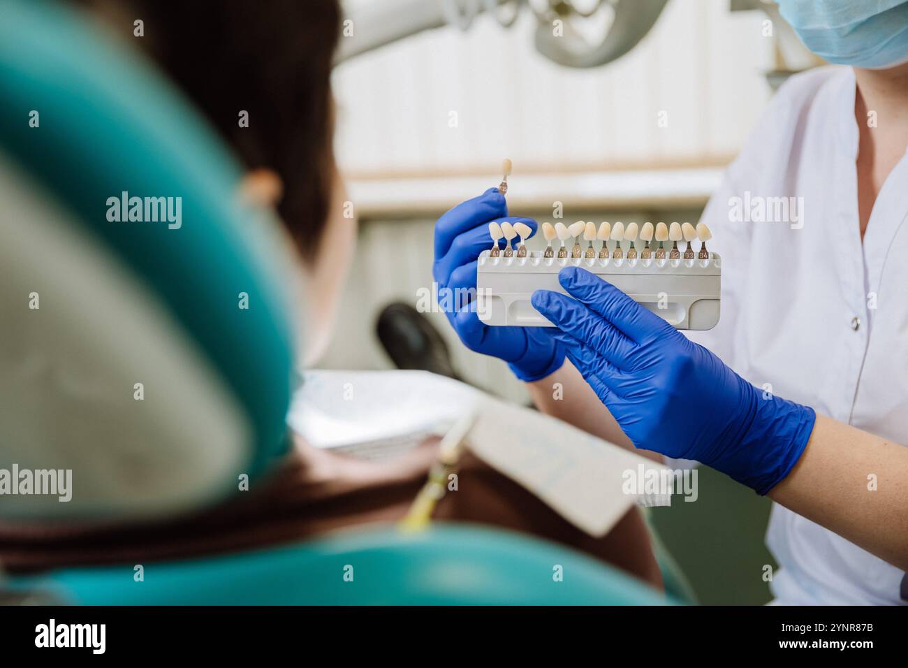Dentist selecting a shade for dental veneers to ensure a perfect match ...
