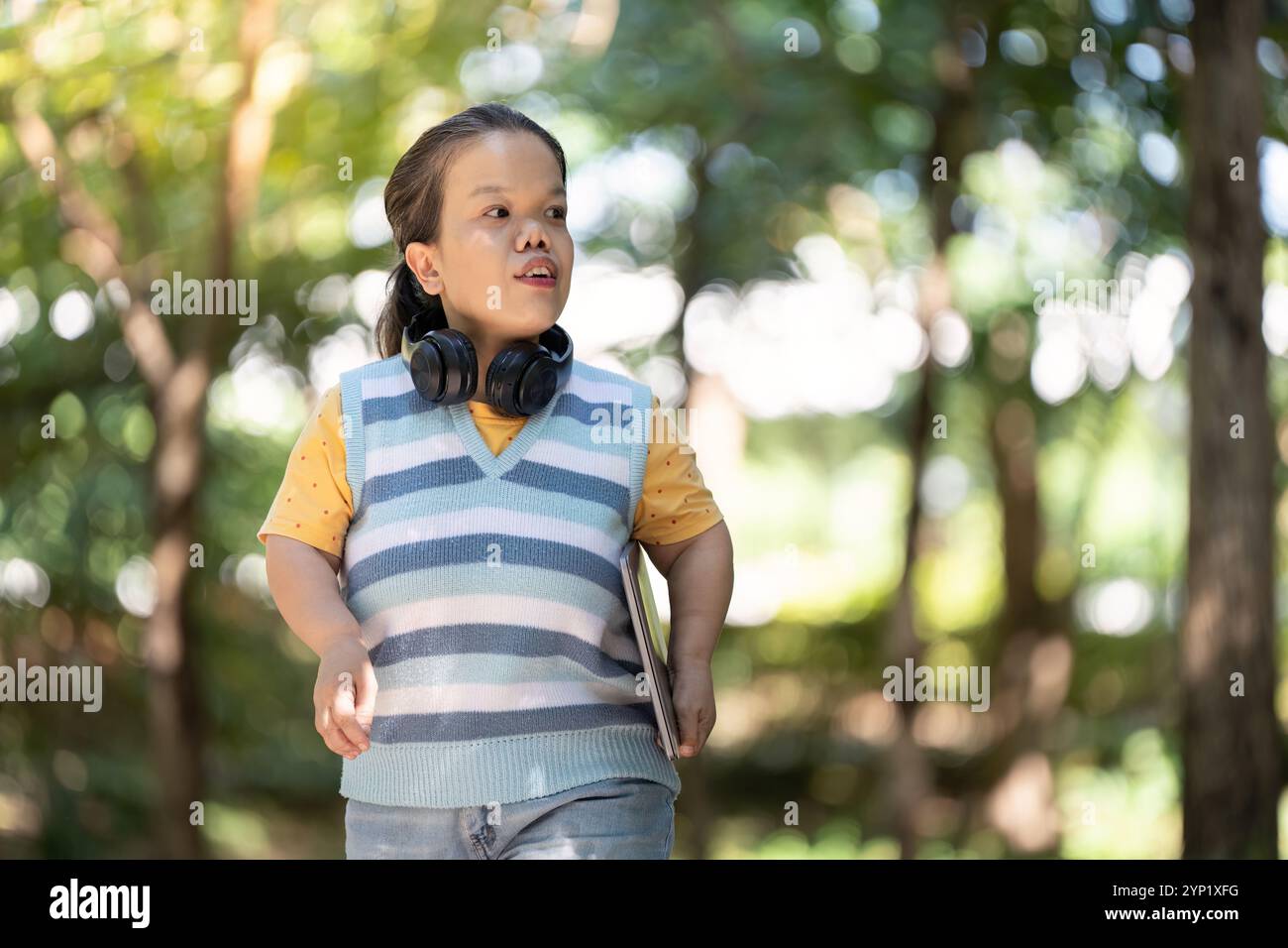 Achondroplasia dwarfism hi-res stock photography and images - Alamy