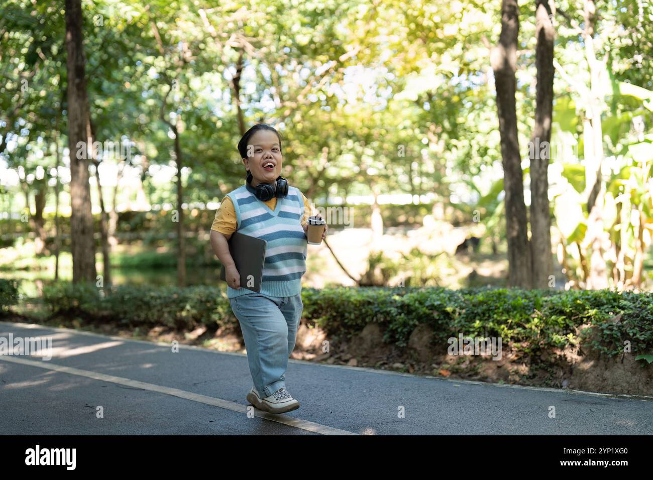 Person with achondroplasia dwarfism hi-res stock photography and images ...