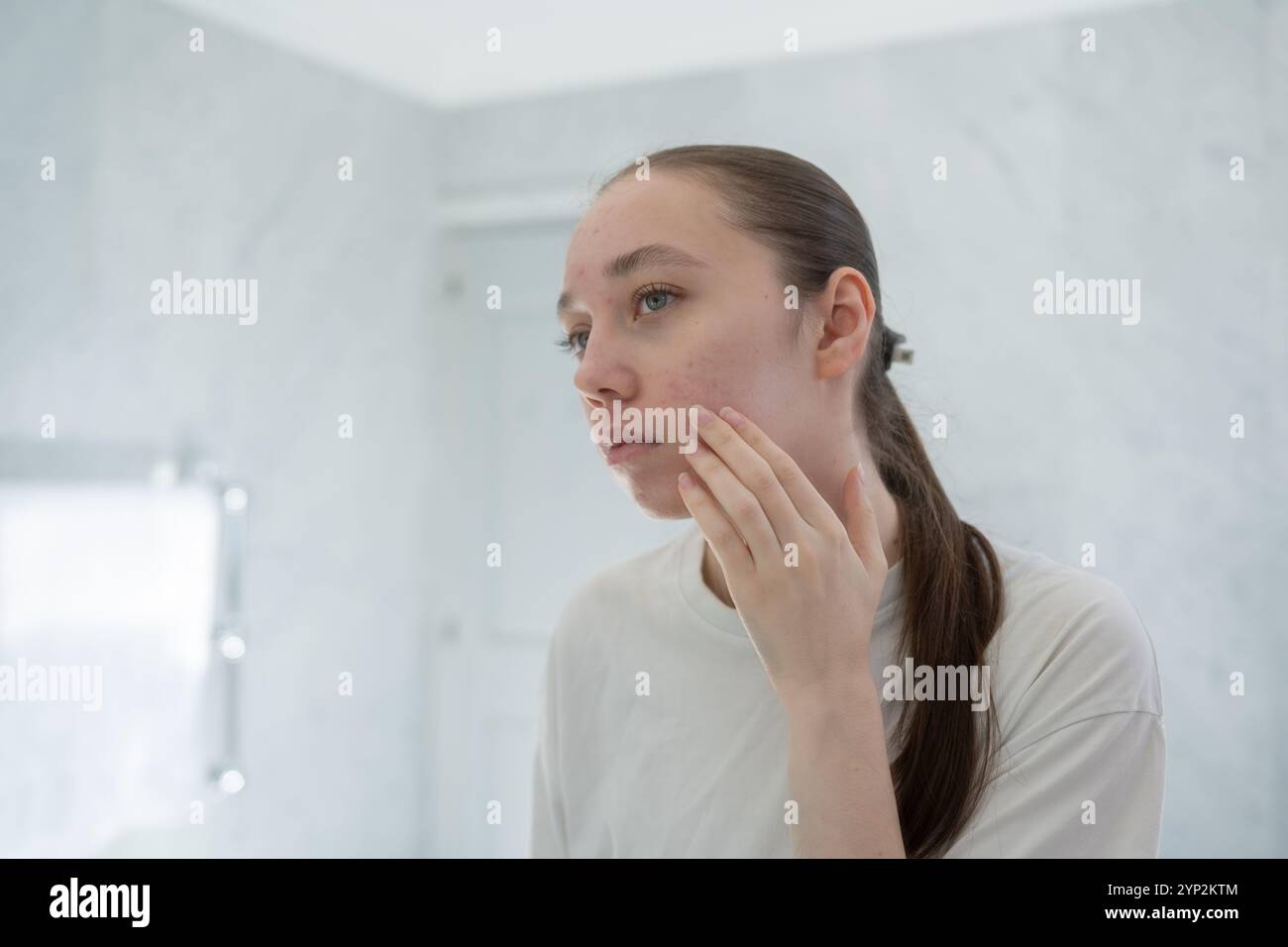 Gen z woman looking at her acne on the cheek, stands before a mirror in ...