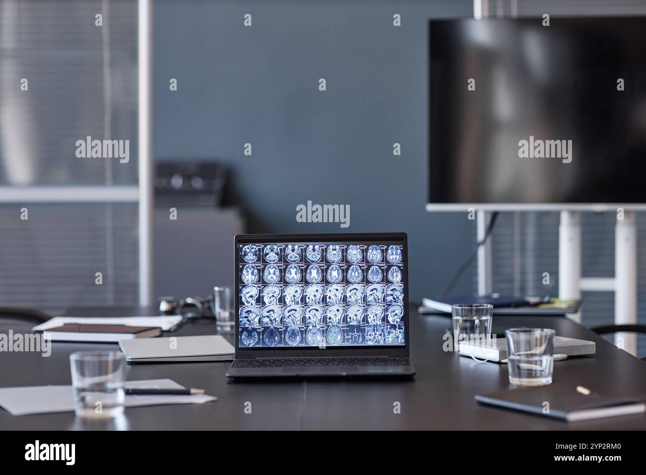 Background shot of open laptop displaying X ray scan imaging of ...