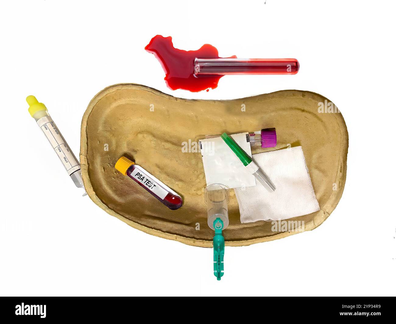 Blood test red tube serum hi-res stock photography and images - Alamy
