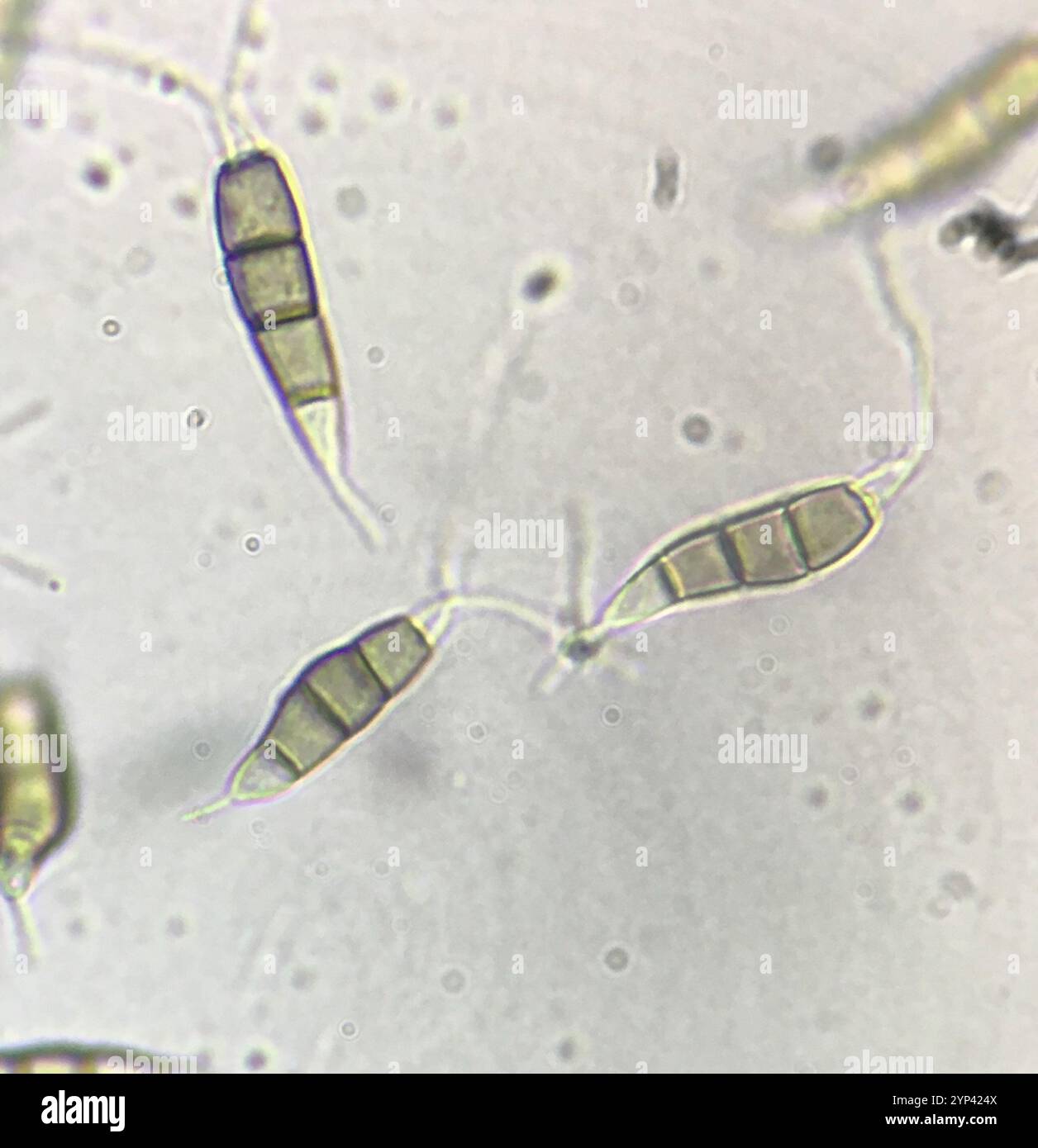 Pestalotiopsis hi-res stock photography and images - Alamy