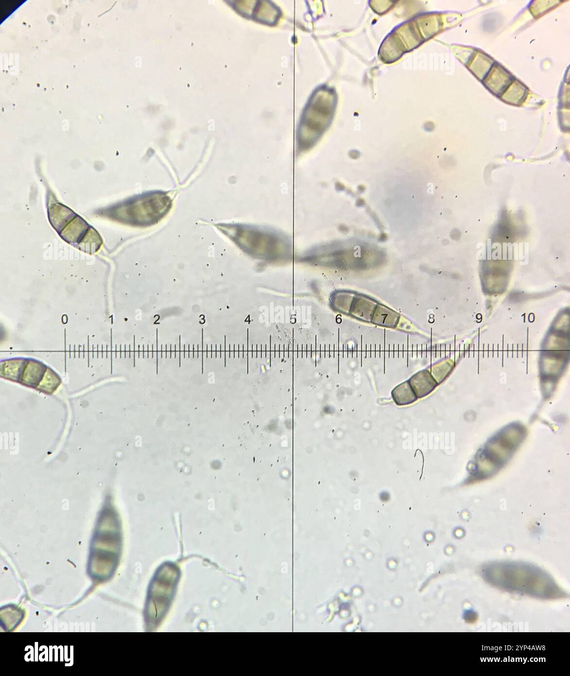 Pestalotiopsis hi-res stock photography and images - Alamy