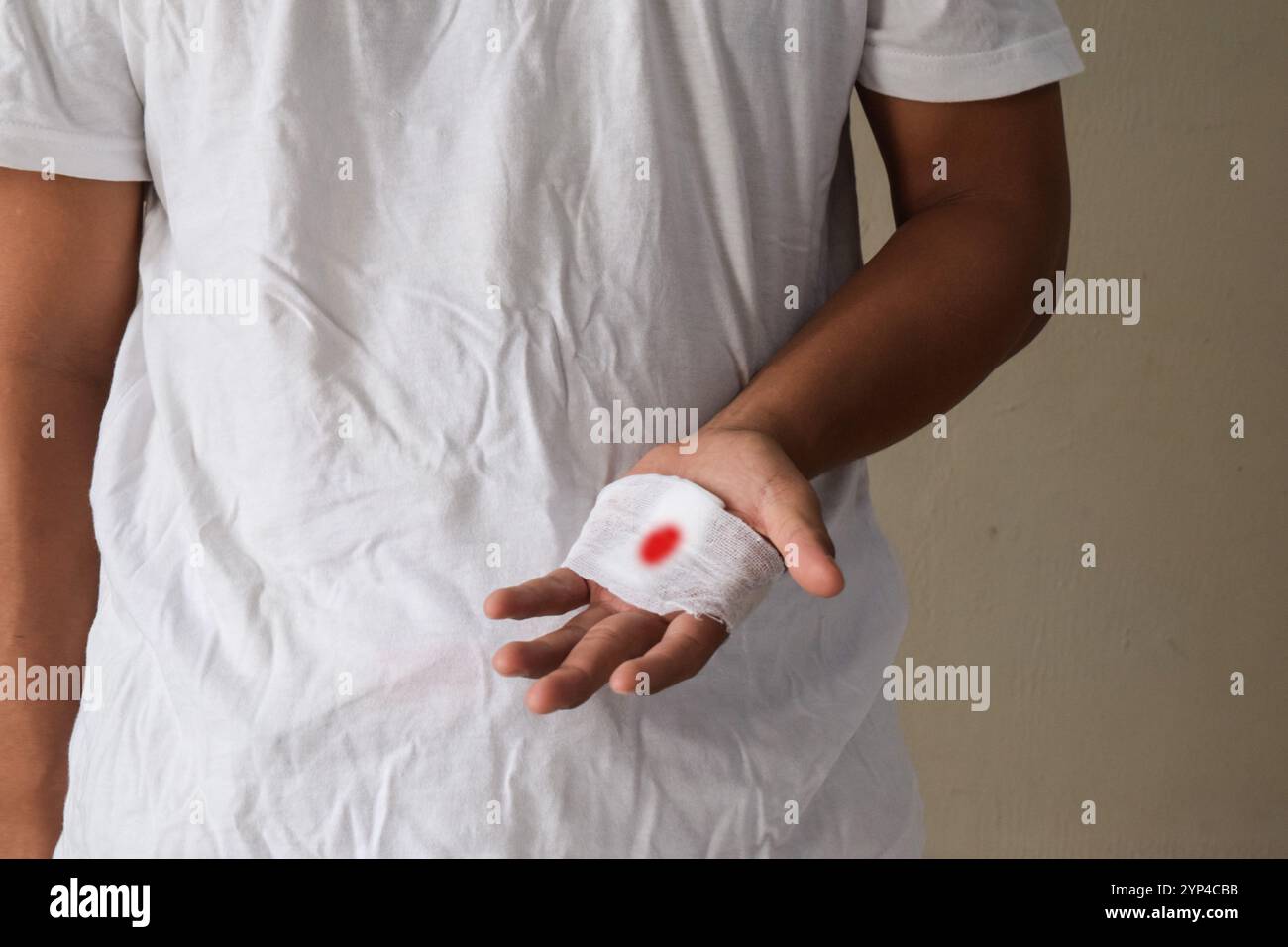 Doctor doing wound dressing care and bandaging patient's hand, hand ...