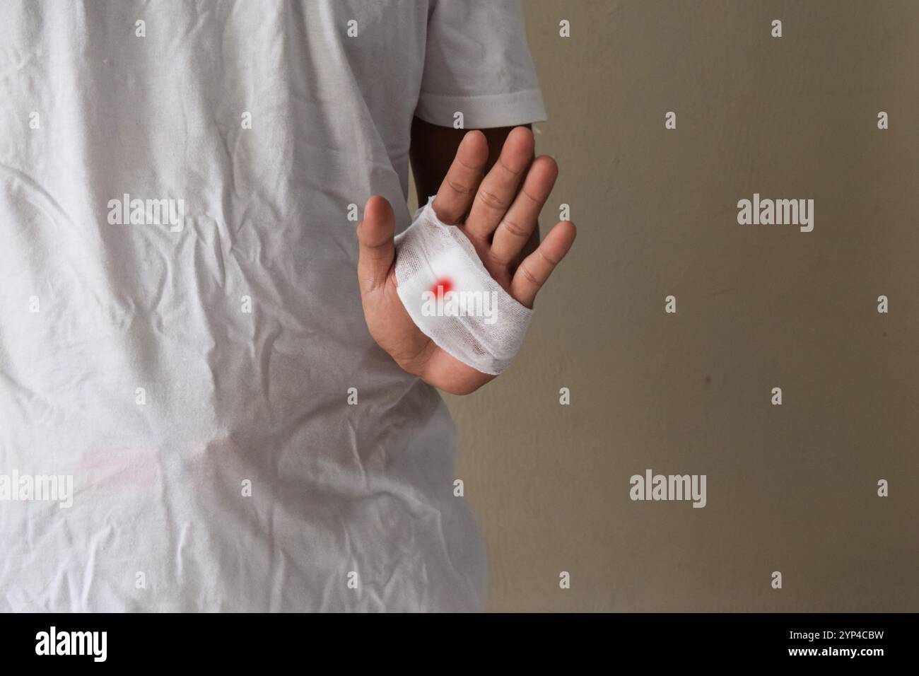 Doctor doing wound dressing care and bandaging patient's hand, hand ...