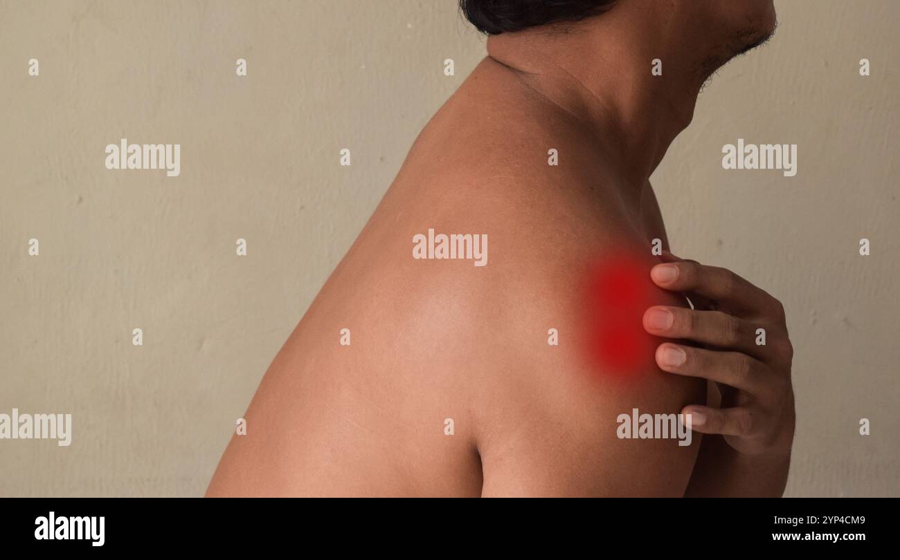 Arthritis and muscle pain relief cream concept. Man having shoulder and ...