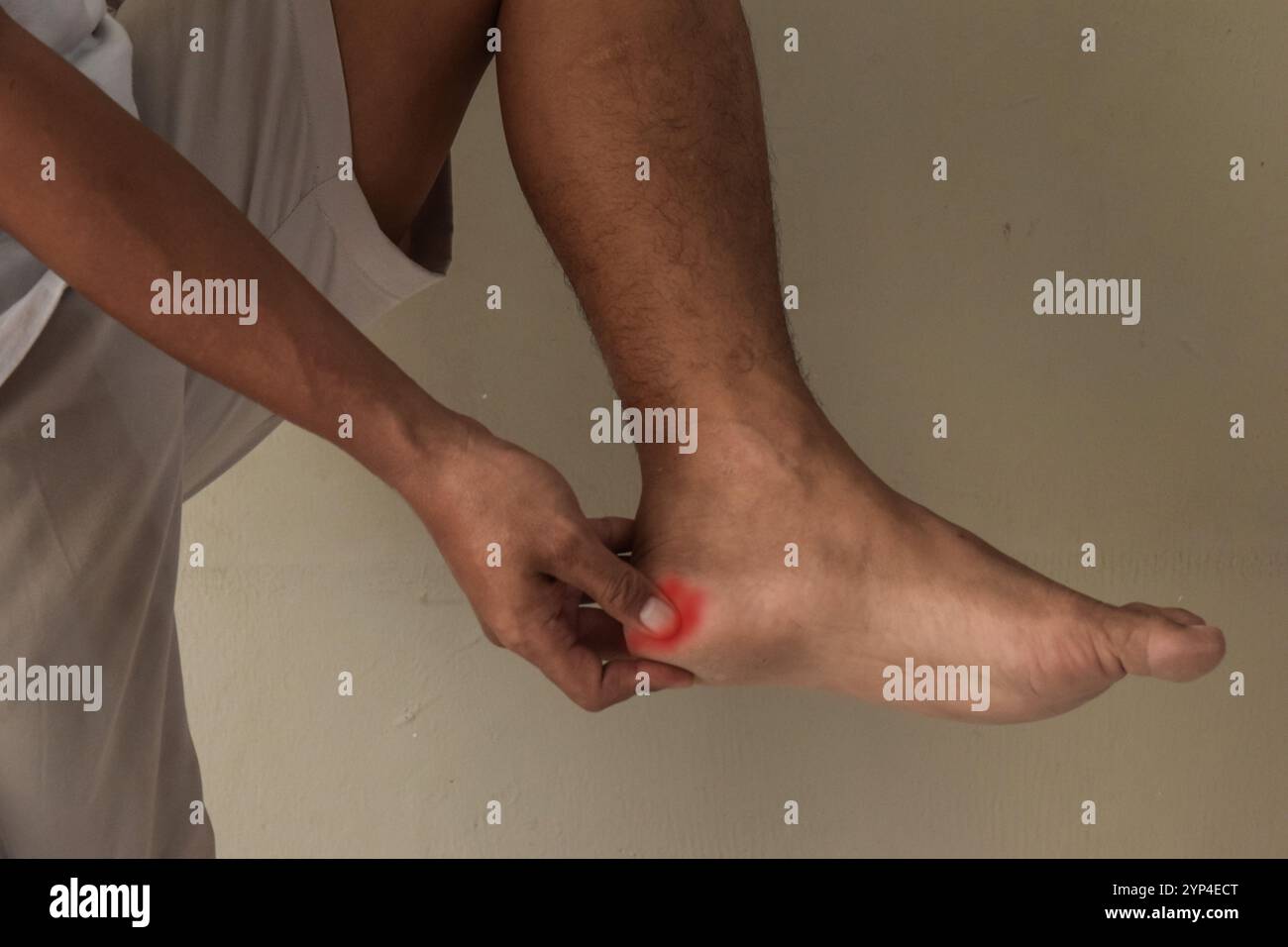 man having heel pain, tendon inflammation, plantar fascitis Stock Photo ...