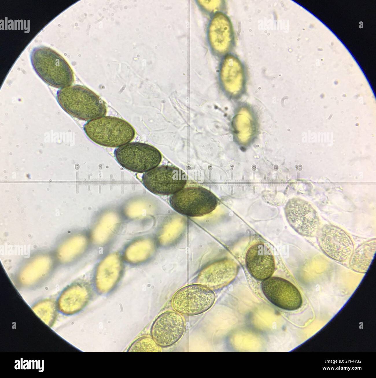 Sordaria fimicola hi-res stock photography and images - Alamy