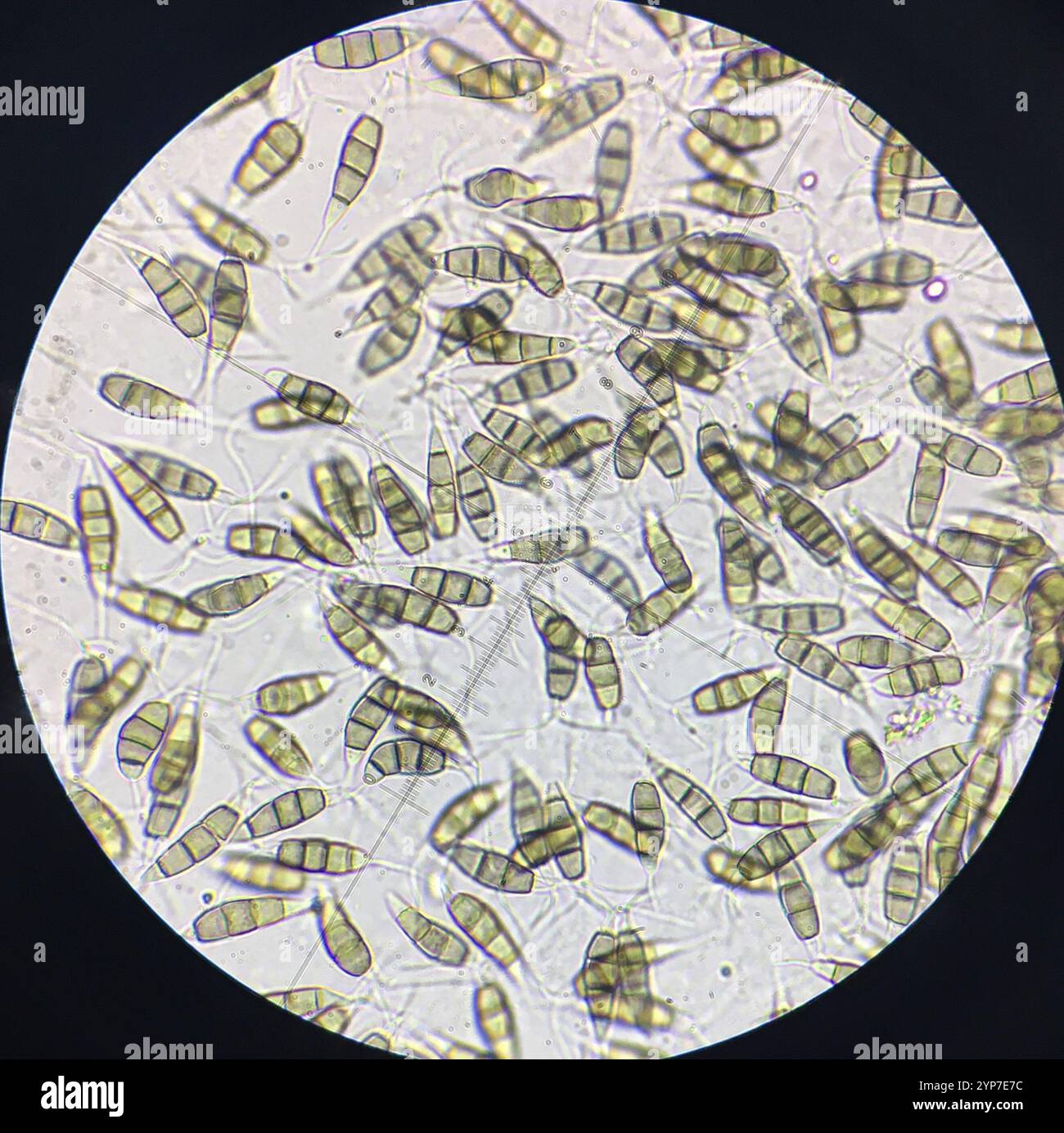 Pestalotiopsis hi-res stock photography and images - Alamy