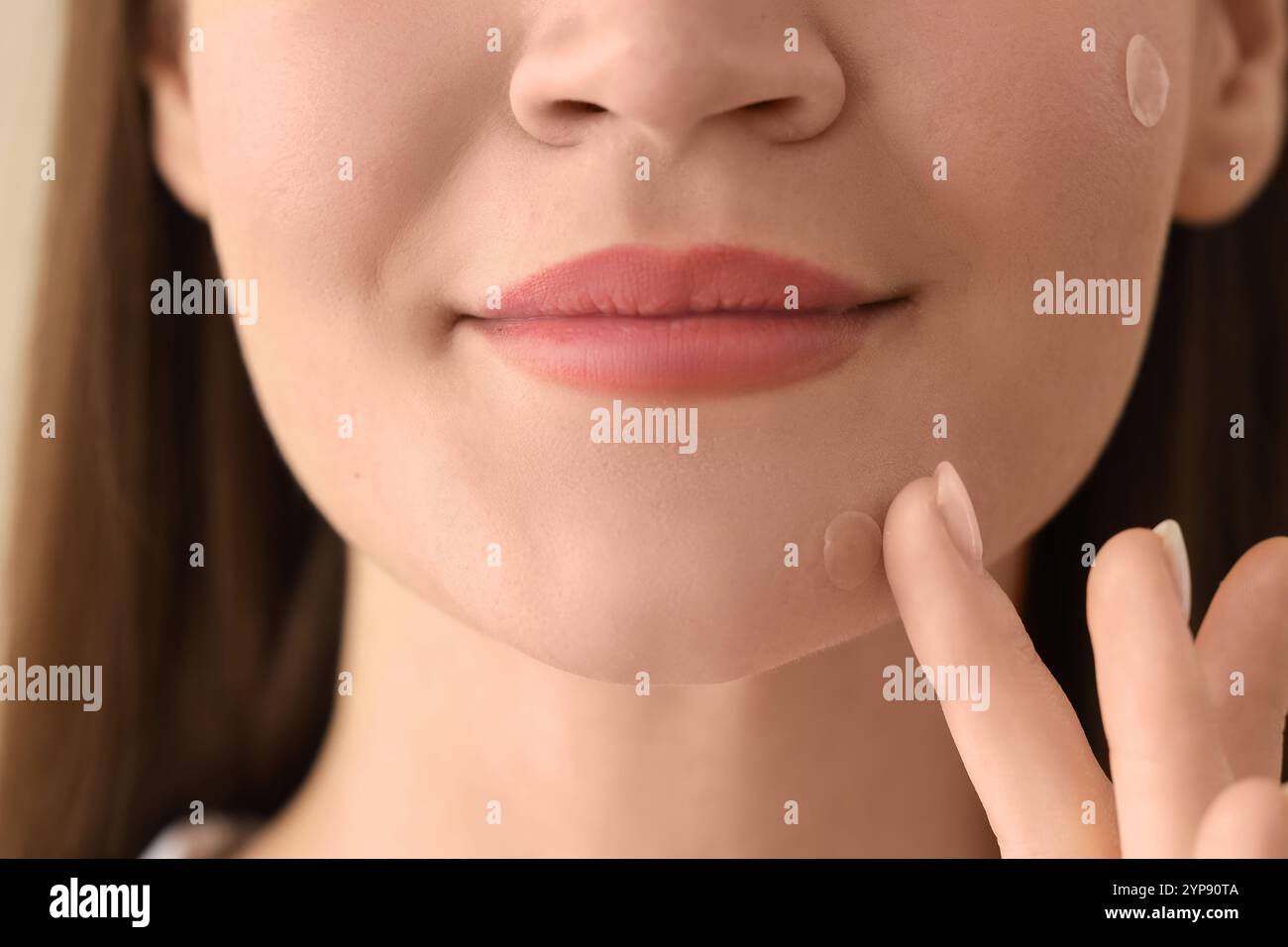 Young woman with pimple patches, closeup Stock Photo - Alamy